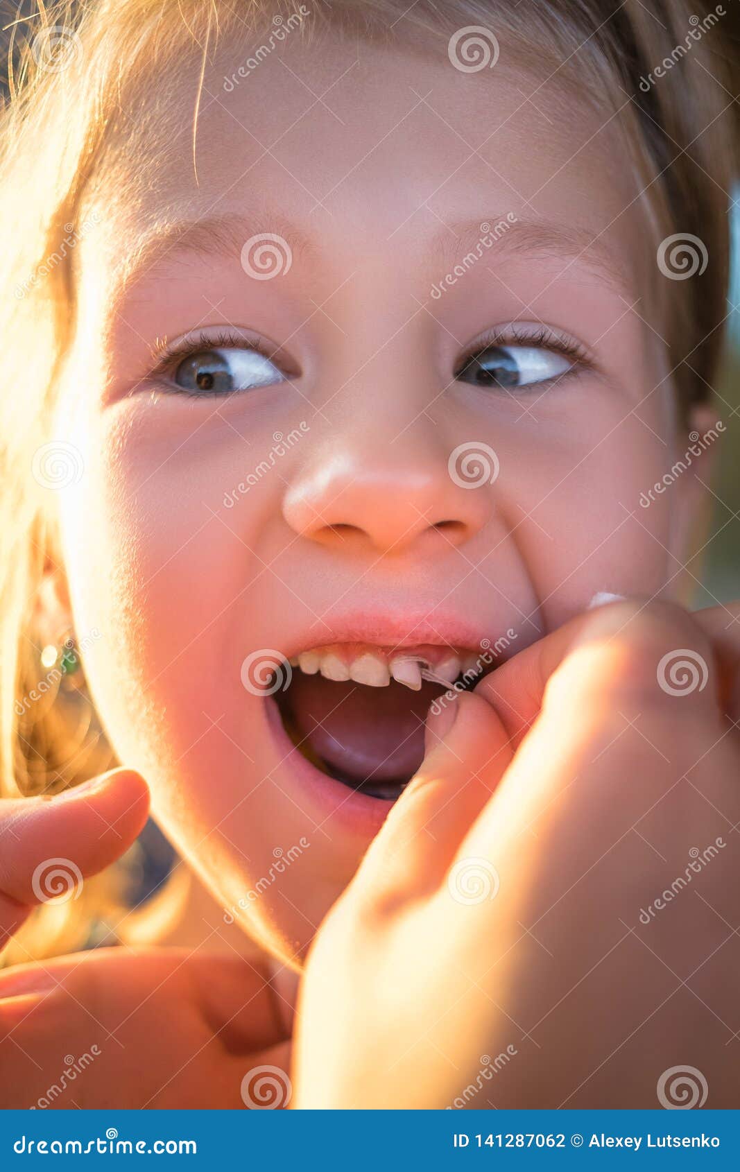 The Process of Removing a Baby Tooth Using a Thread Stock Photo - Image ...