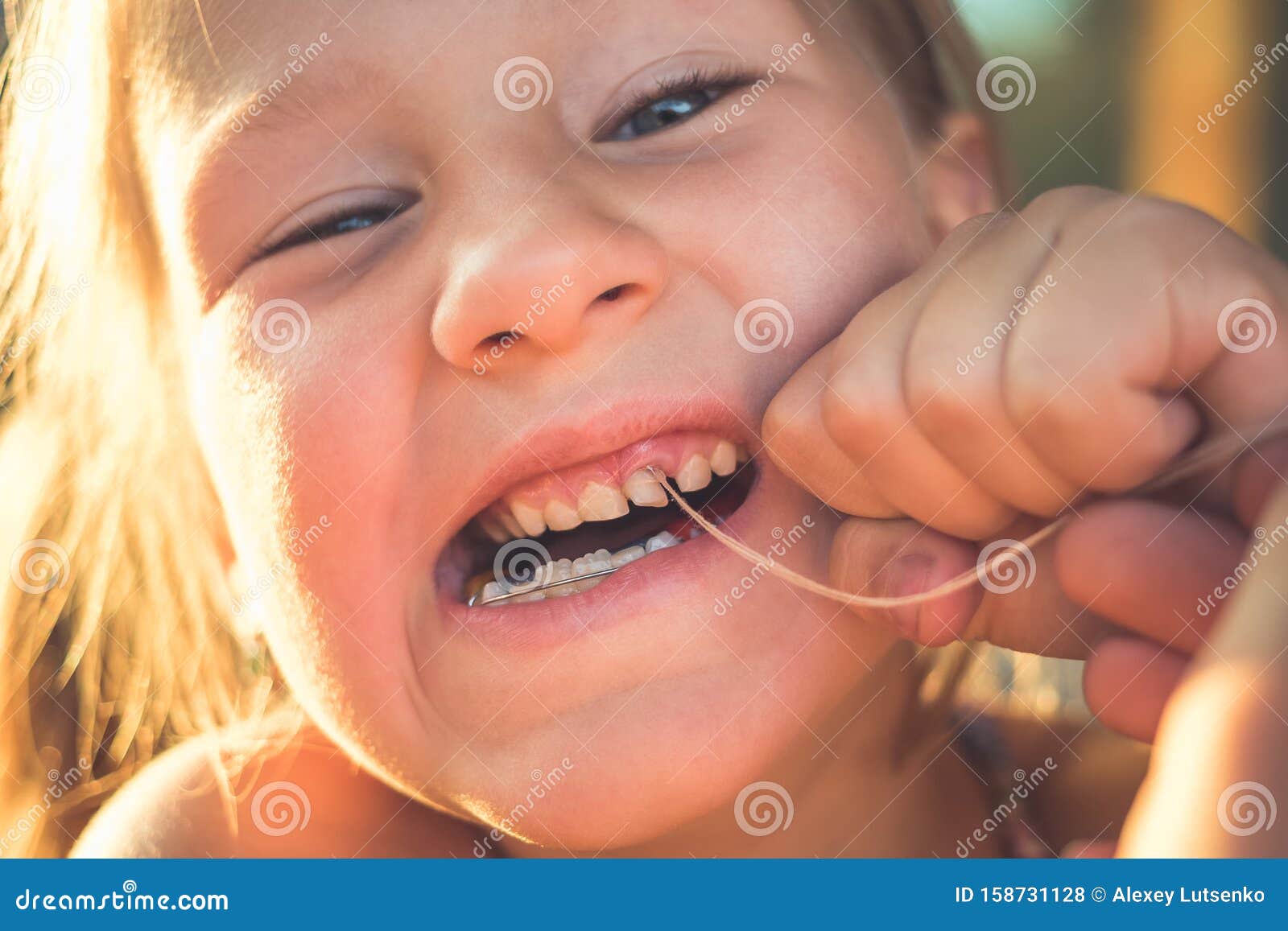 The Process of Removing a Baby Tooth Using a Thread Stock Photo - Image ...