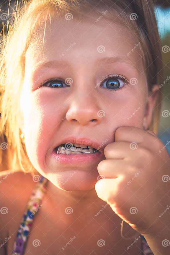 The Process of Removing a Baby Tooth Using a Thread Stock Photo - Image ...