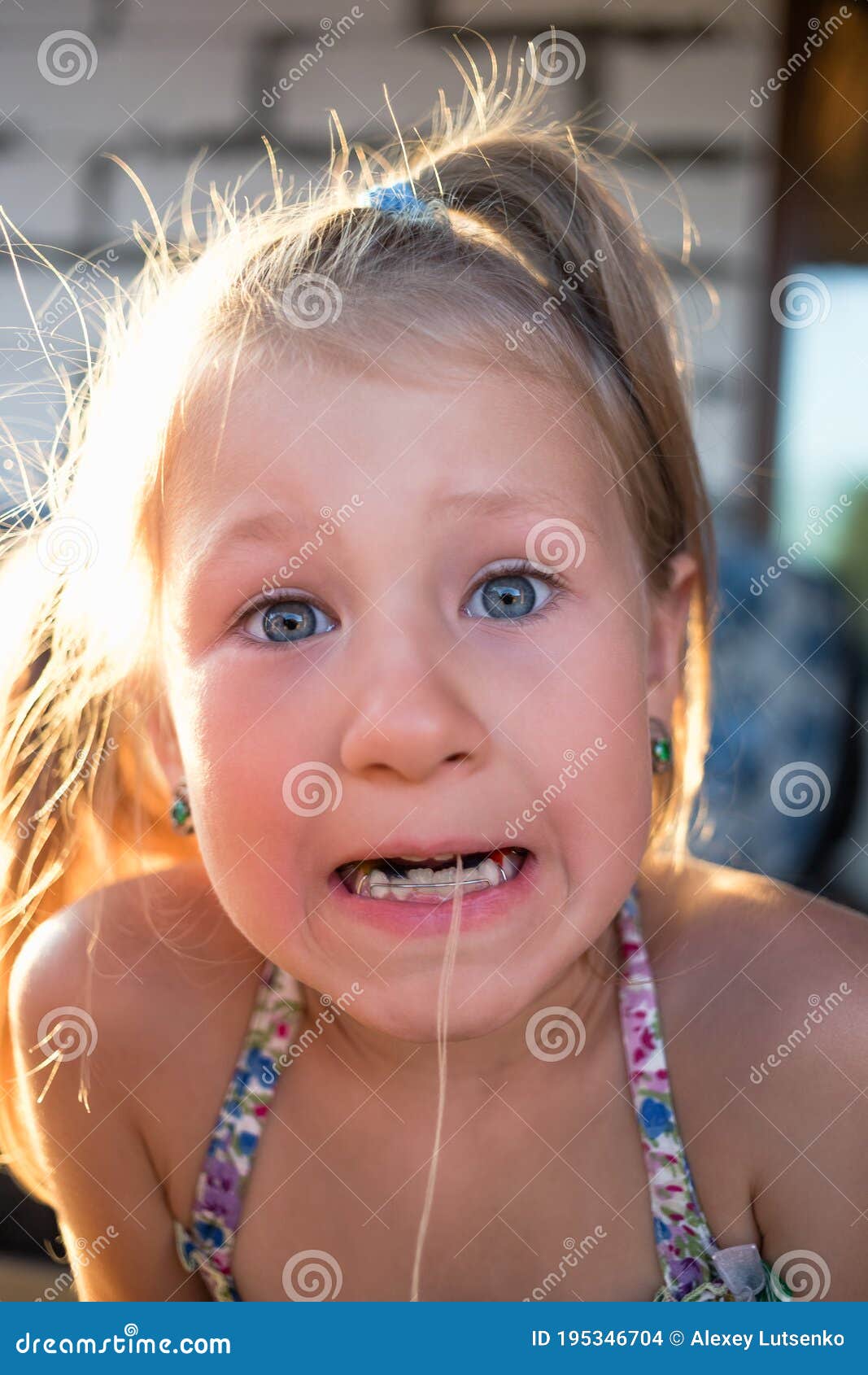 The Process of Removing a Baby Tooth Using a Thread Stock Photo - Image ...