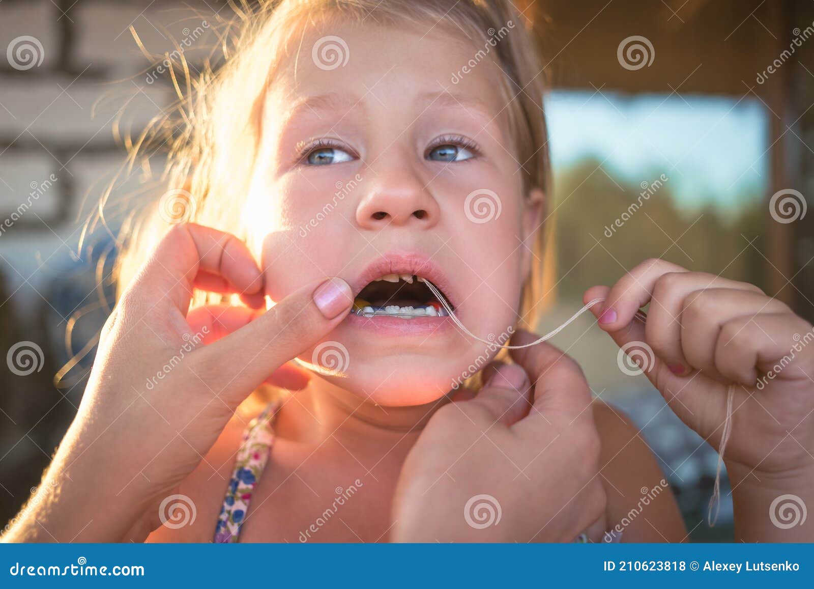 The Process of Removing a Baby Tooth Using a Thread Stock Photo - Image ...