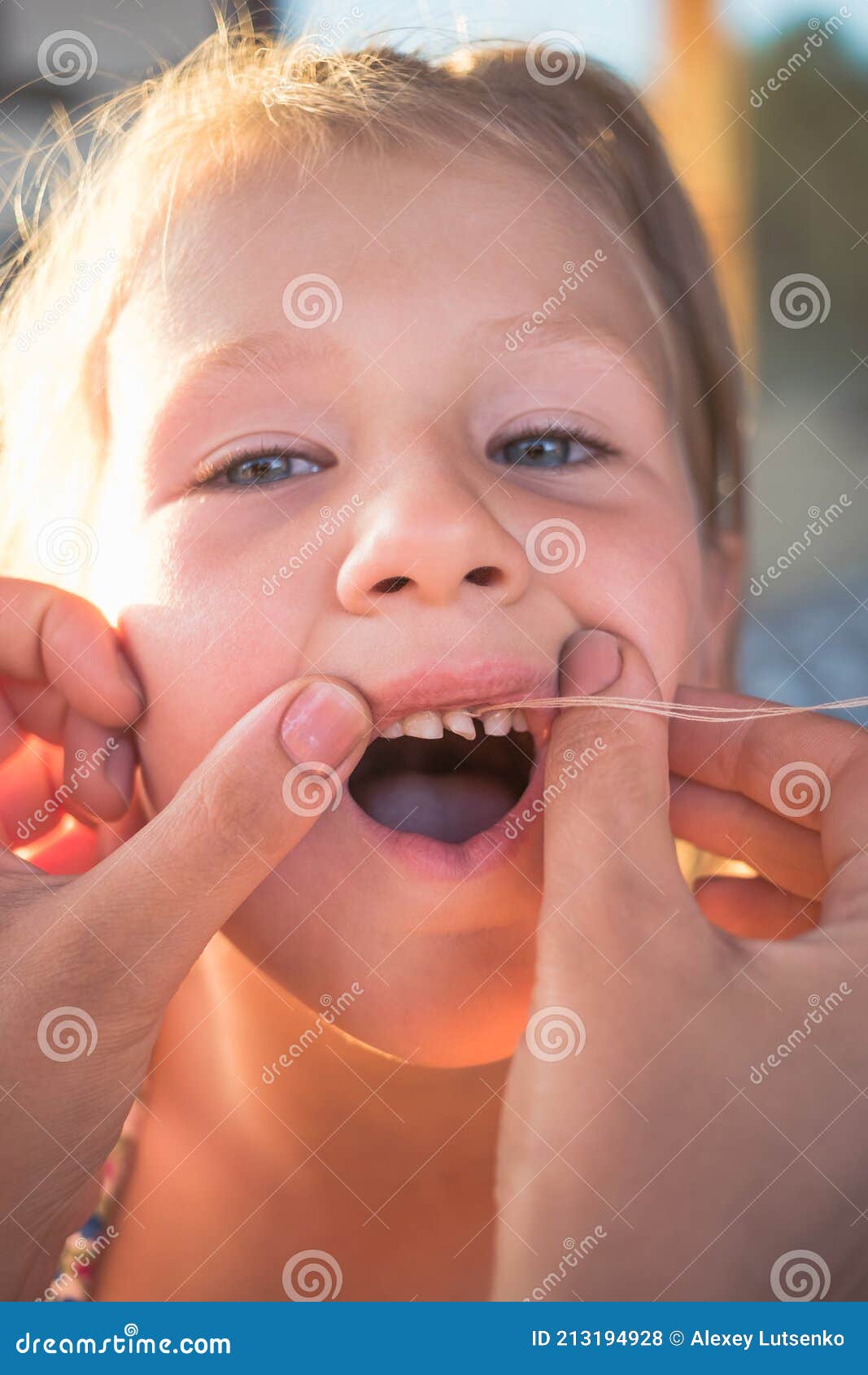 The Process of Removing a Baby Tooth Using a Thread Stock Photo - Image ...