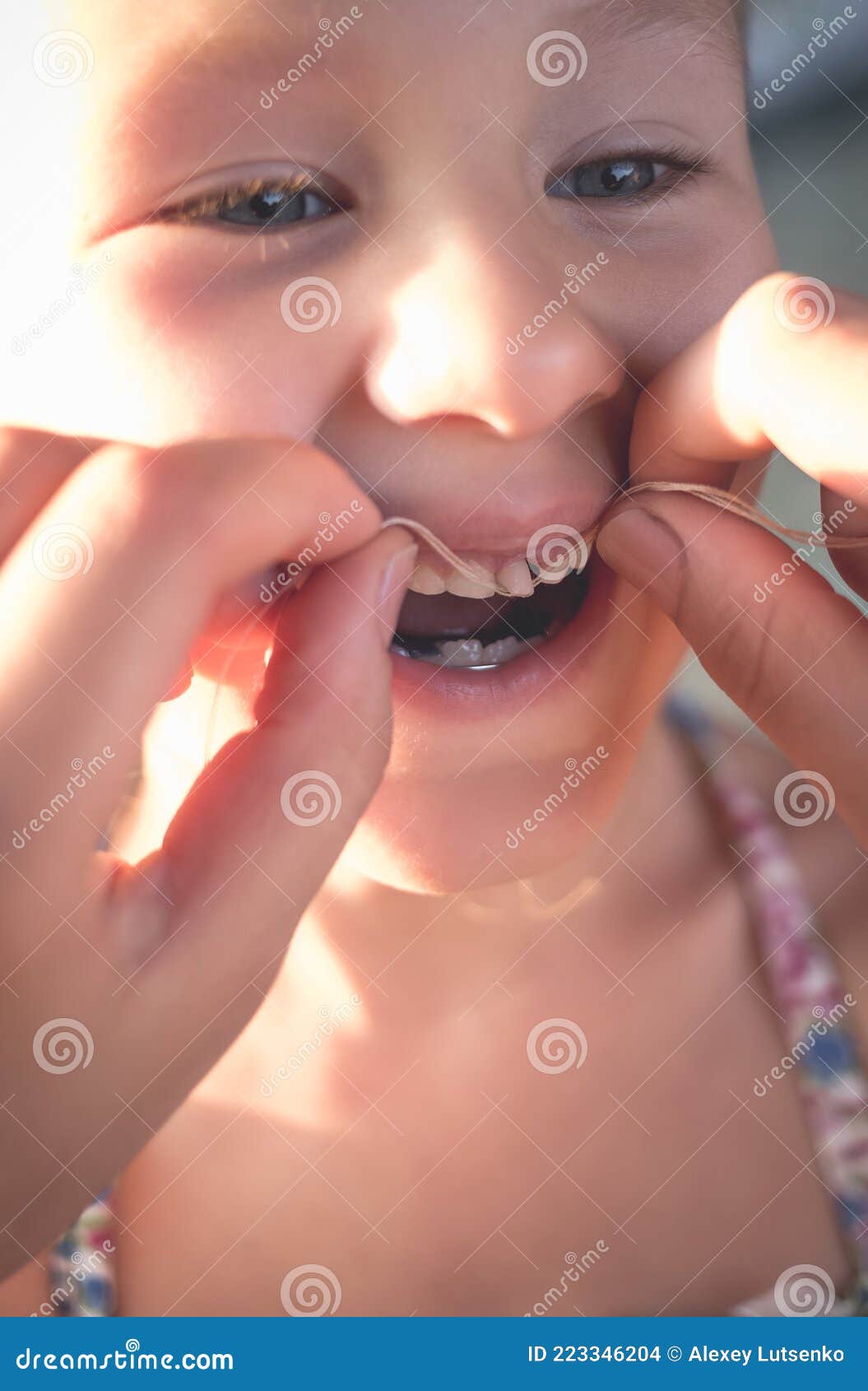 The Process of Removing a Baby Tooth Using a Thread Stock Photo - Image ...