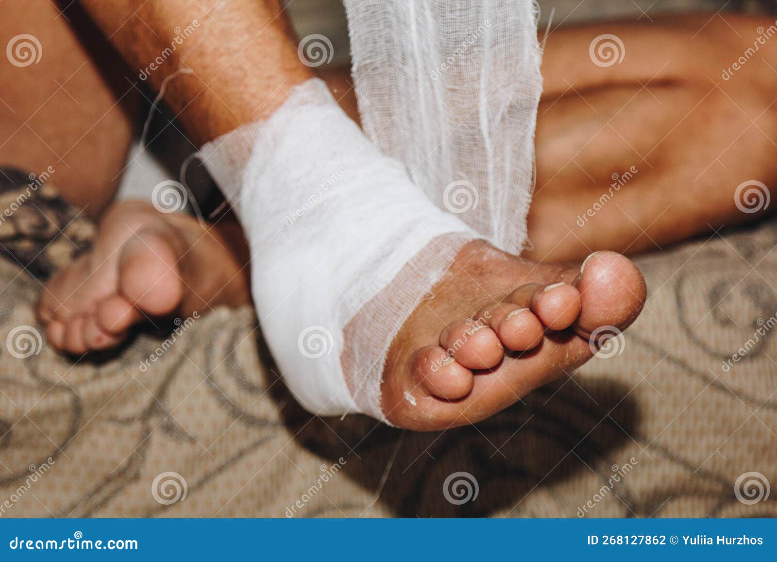 The Process of Self-bandaging the Leg after Surgery. Dressing Injuries ...