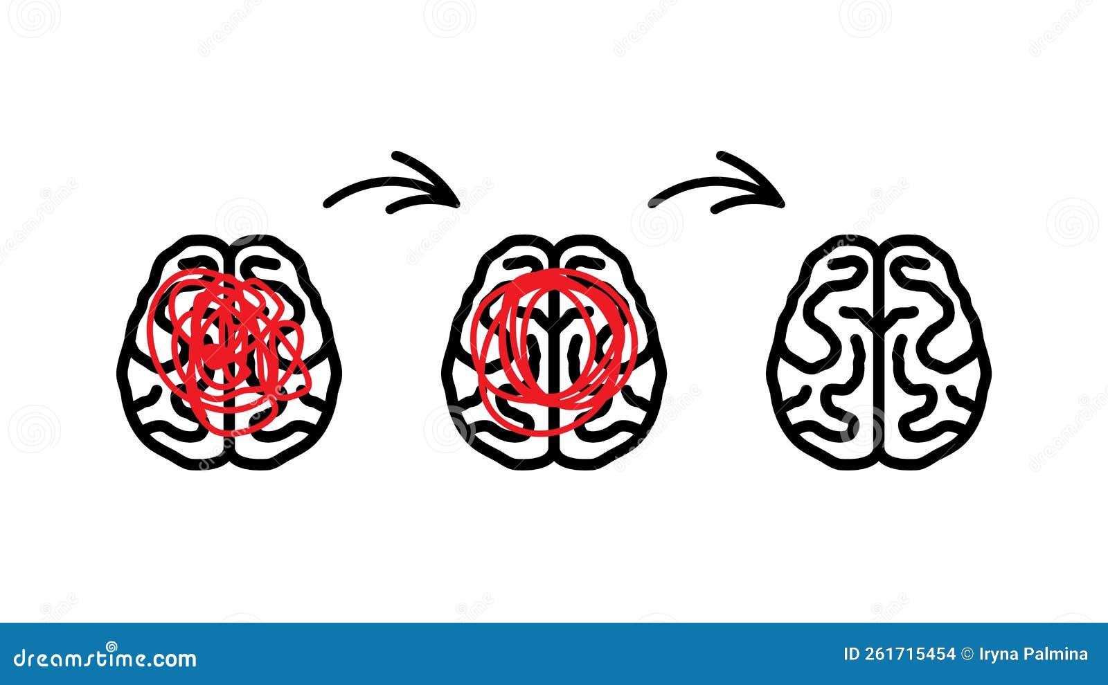 Process of Solving Psychological Problems Concept Stock Vector ...
