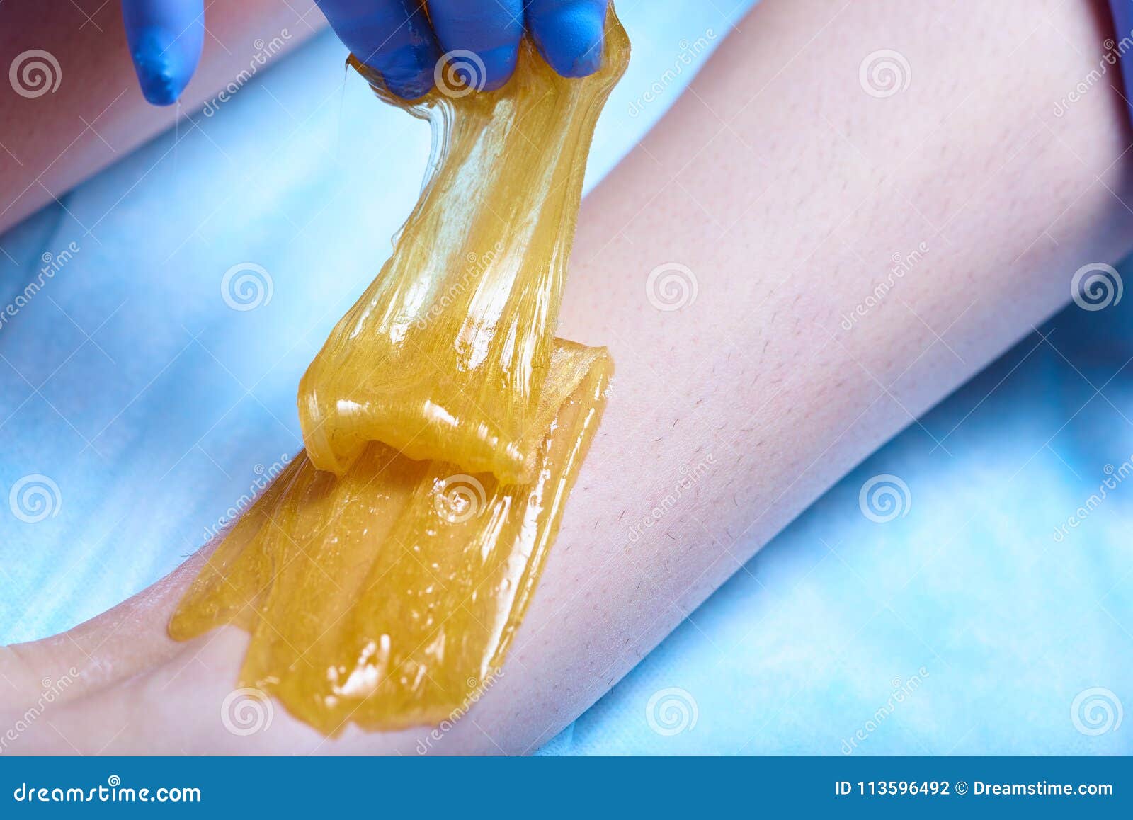 A Process of Sugaring Depilation Stock Photo - Image of beautiful ... A Process of Sugaring Depilation Stock Photo - Image of beautiful ...