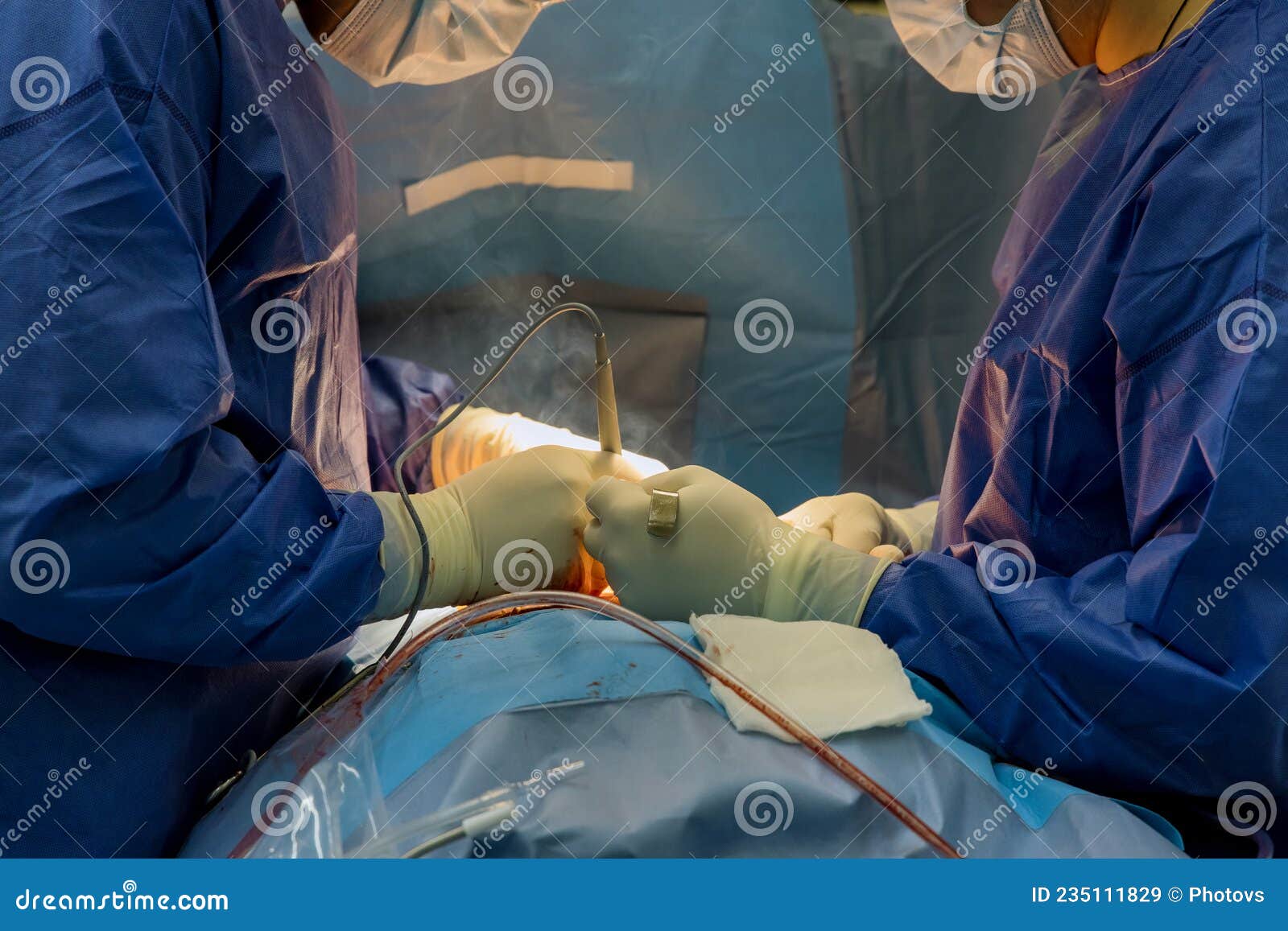 Process Surgery of Operation Using Medical Equipment in Operating Room ...
