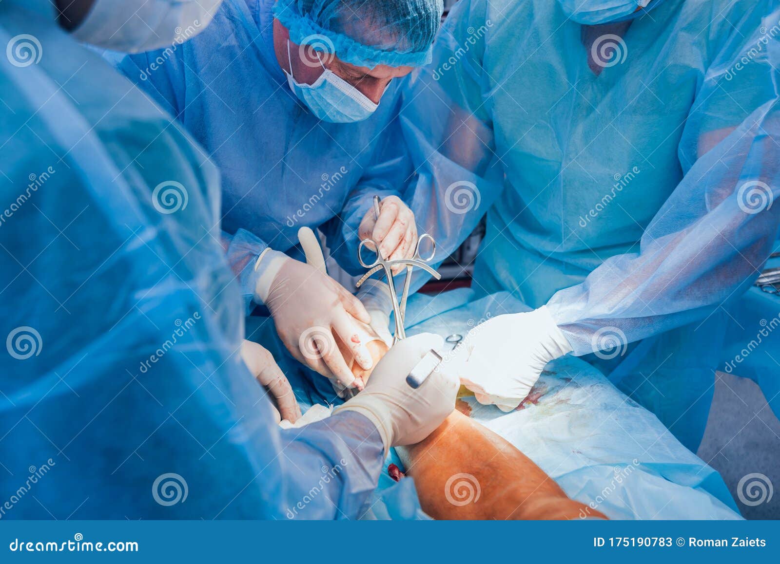 Process of Trauma Surgery Operation. Group of Surgeons in Operating ...