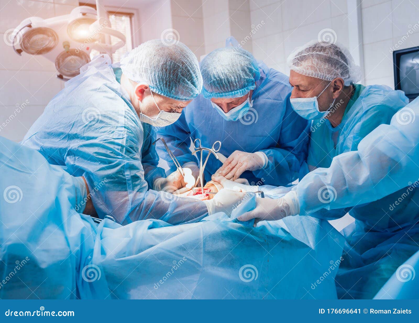 Process of Trauma Surgery Operation. Group of Surgeons in Operating ...