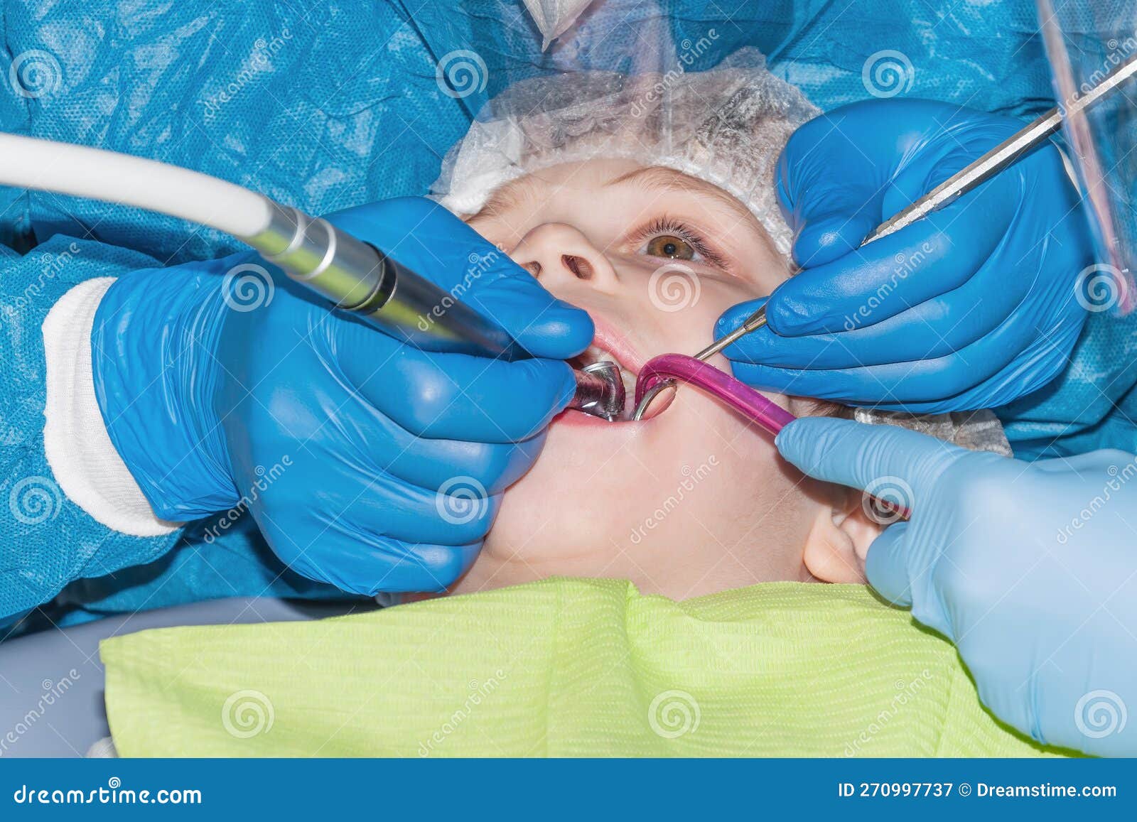 The Process of Treating a Sick Tooth in a Child Stock Image - Image of ...