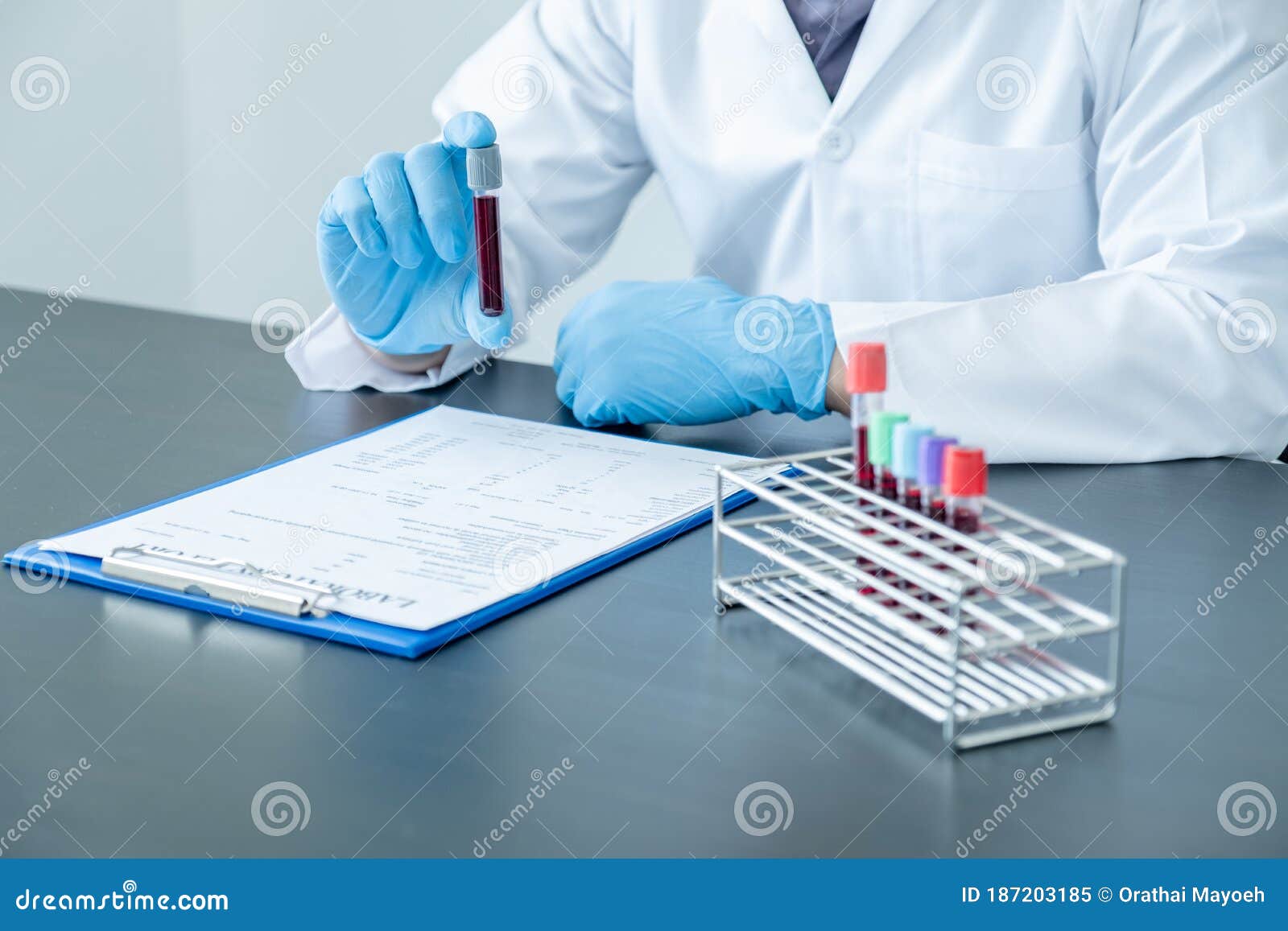Professional Doctors Perform Find Virus Tests from Samples of Blood ...