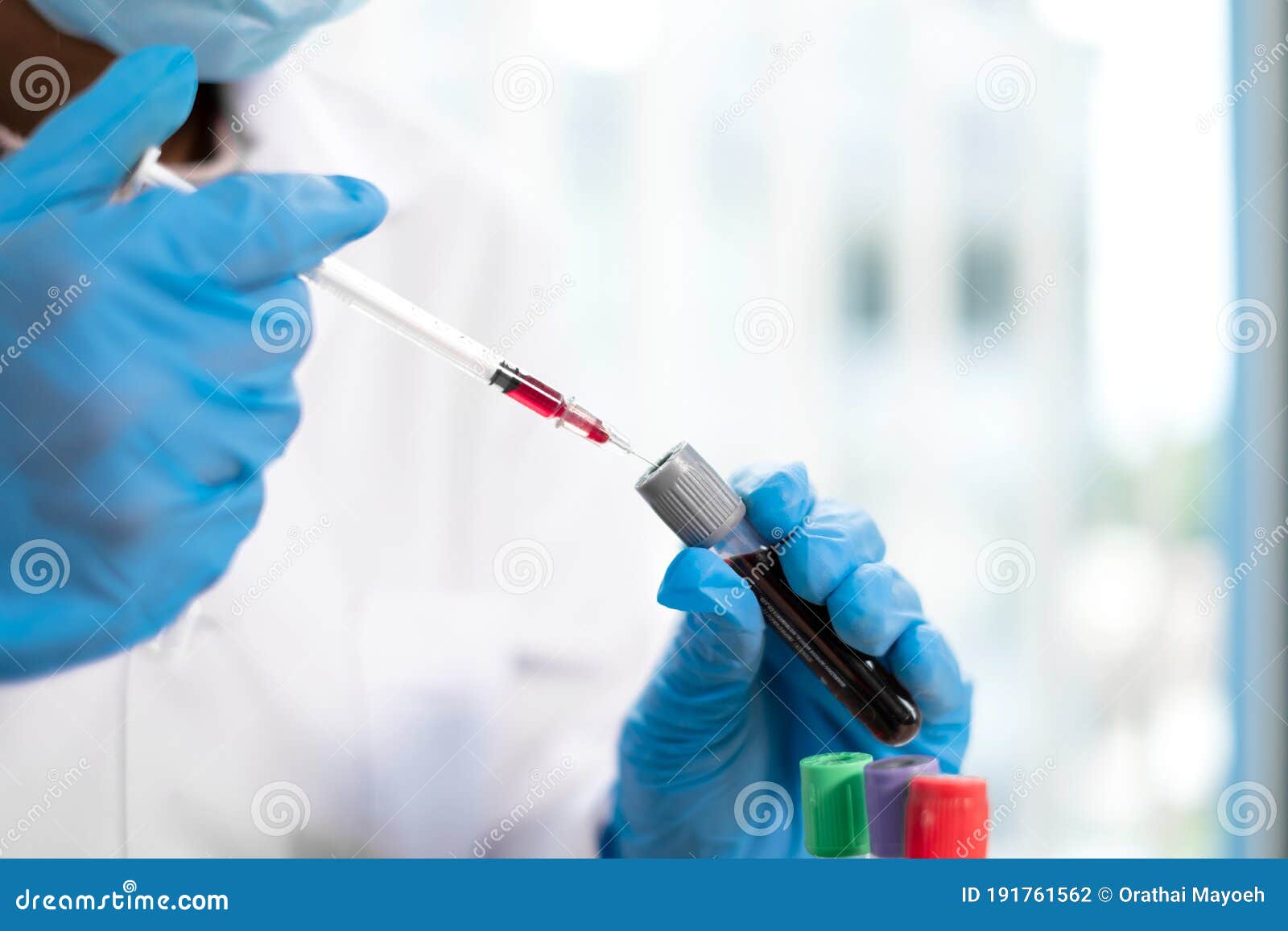 Professional Doctors Perform Find Virus Tests from Samples of Blood ...