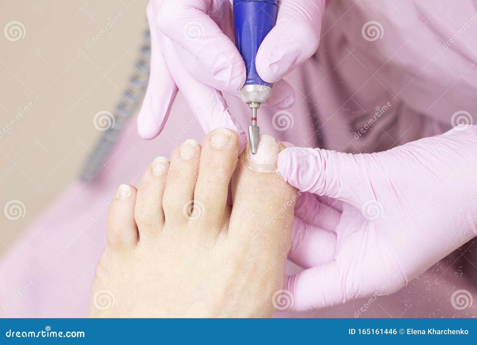 Professional Hardware Pedicure Using an Electric Machine. Patient at ...