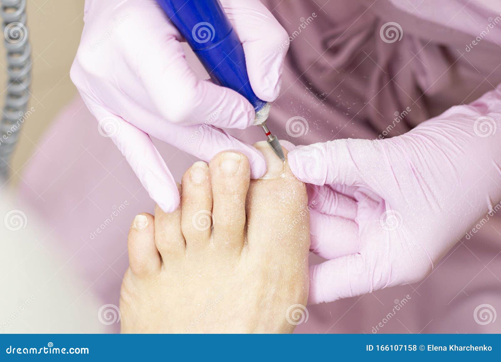 Professional Hardware Pedicure Using an Electric Machine. Patient at ...