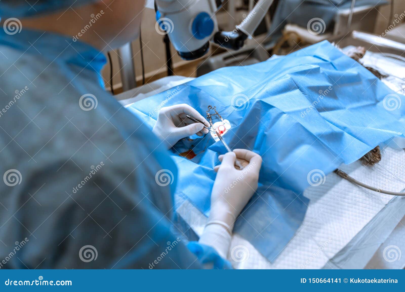 A Professional Ophthalmologist Performs Eye Surgery with a Microscope ...