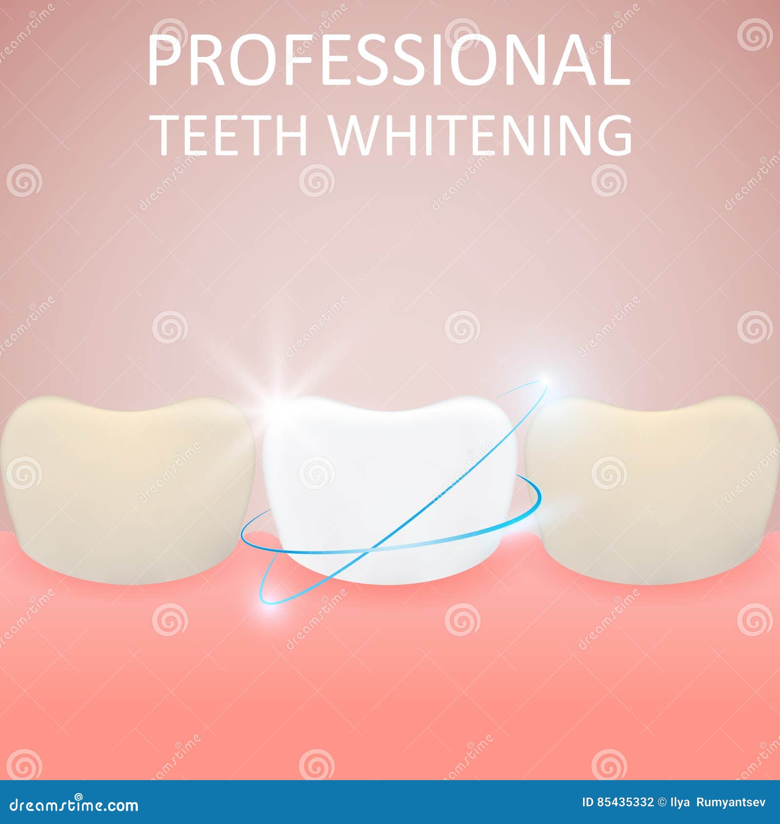 Professional Teeth Whitening, Healthy Tooth and Yellow Teeth, Stock ...