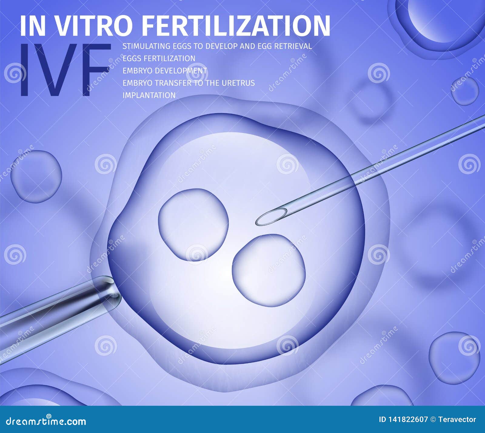 Ivf Banner Stock Illustrations – 261 Ivf Banner Stock Illustrations ...