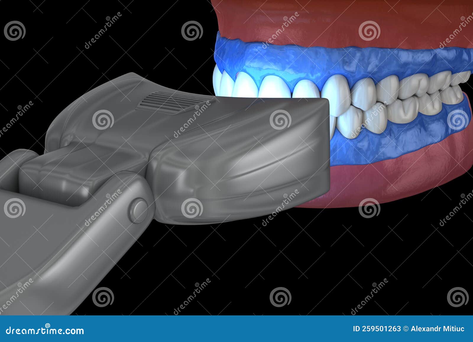 Tooth Before And After Bleaching And Cleaning Vector Illustration ...
