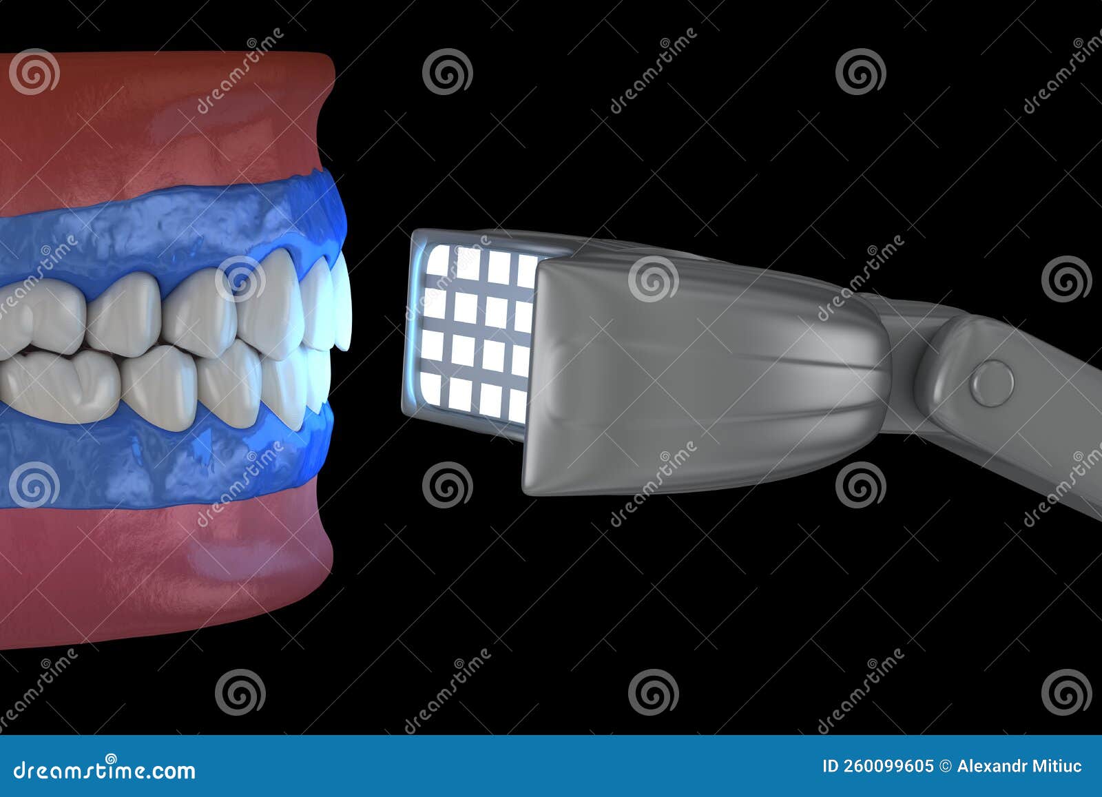Proffesioinal Teeth Whitening Light Activation On Tooth Bleaching 3d Illustration Concept