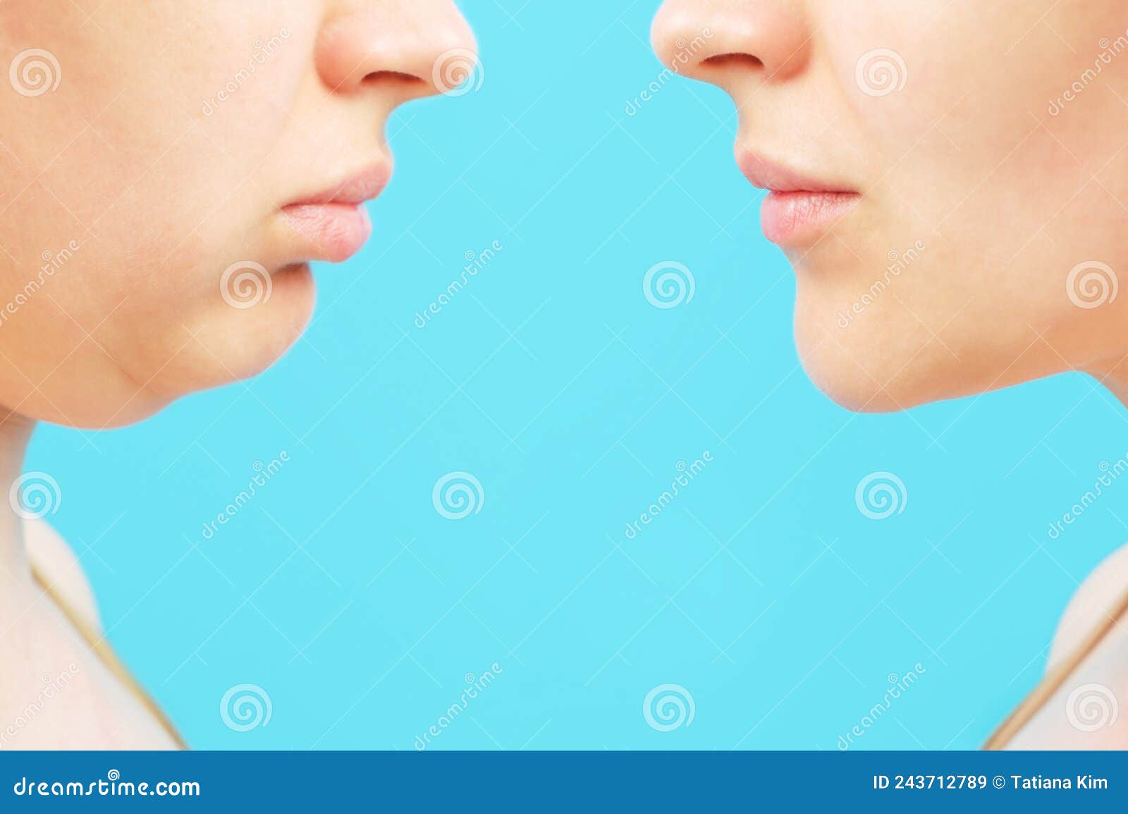 Profile of Female Face with and without a Second Chin, Concept before ...