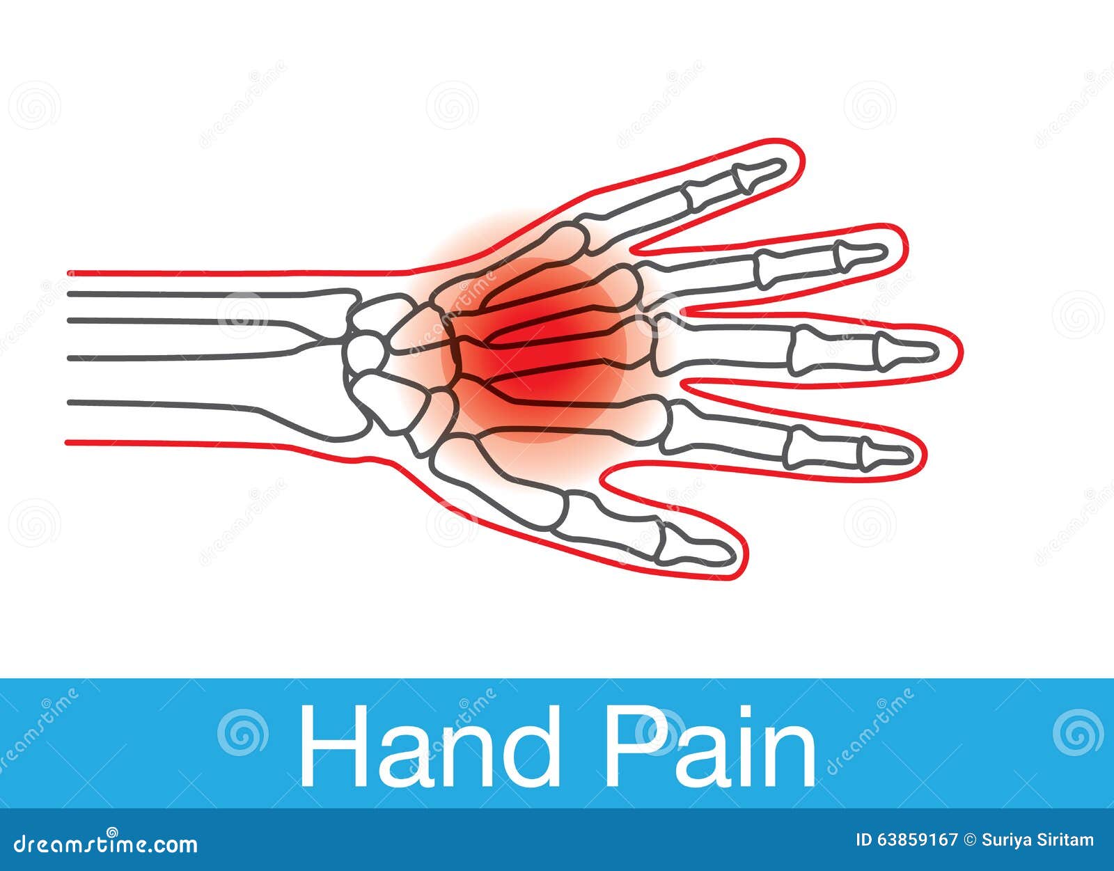 Profilo Di Dolore Della Mano Illustrazione Vettoriale - Illustrazione ...