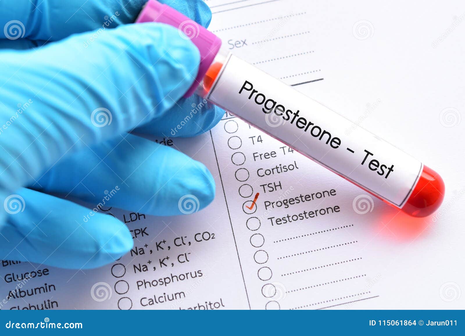 Progesterone hormone test stock photo. Image of cancer - 115061864