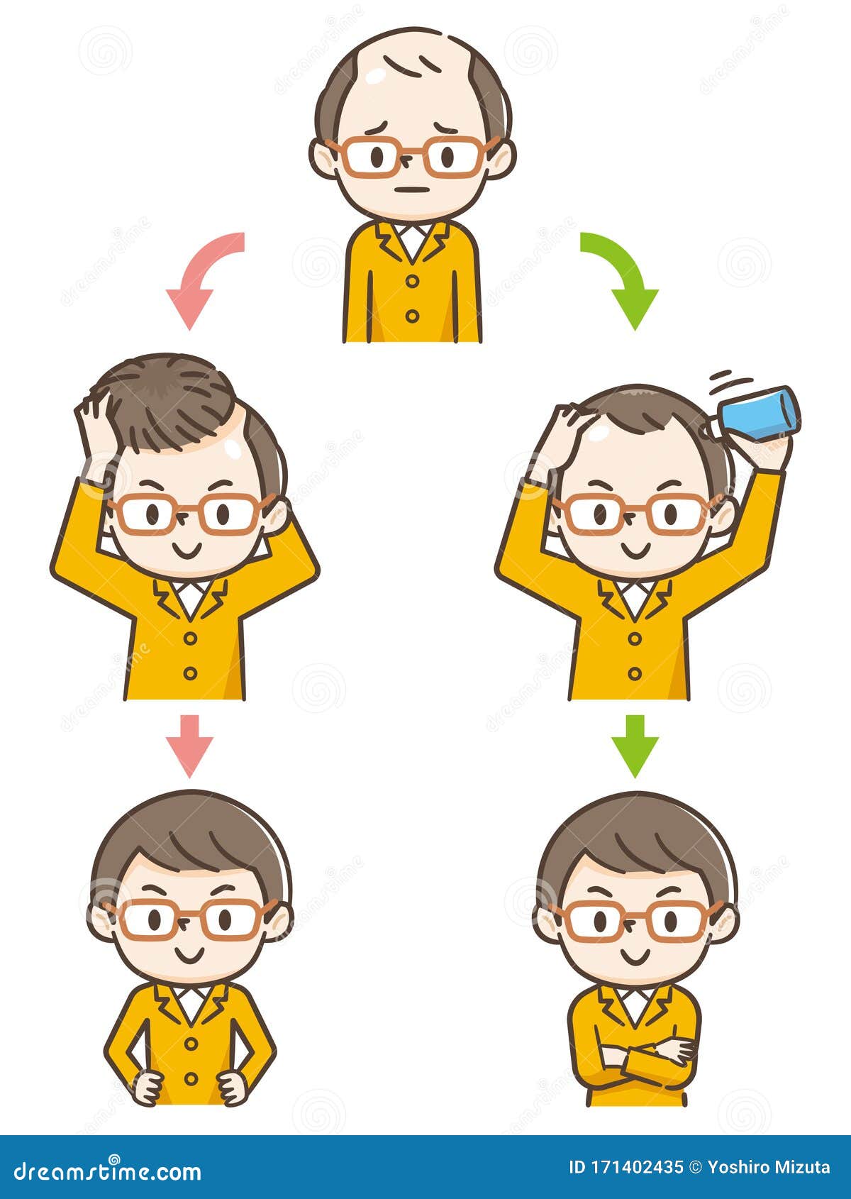 Progress of Thinning Hair and Countermeasures Stock Vector ...