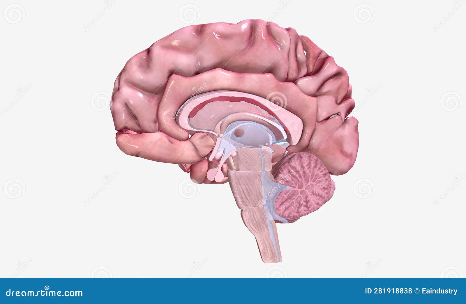 Progression of Multiple Sclerosis Sagittal View Stock Illustration ...