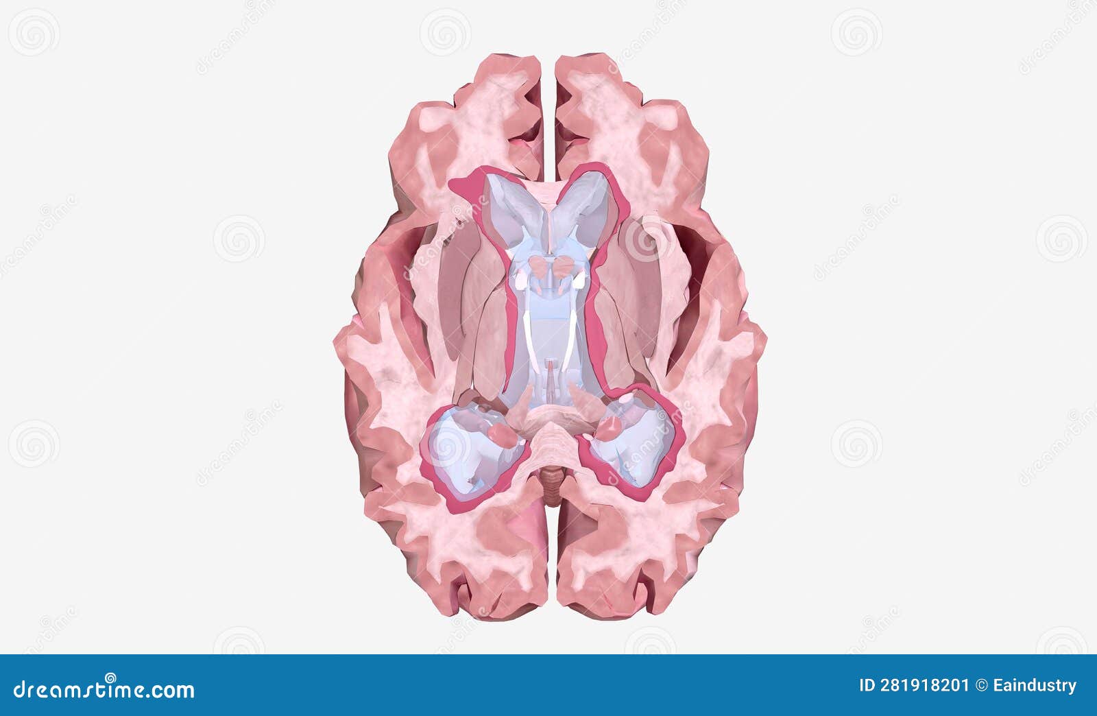 Progression of Multiple Sclerosis Transverse View Stock Illustration ...