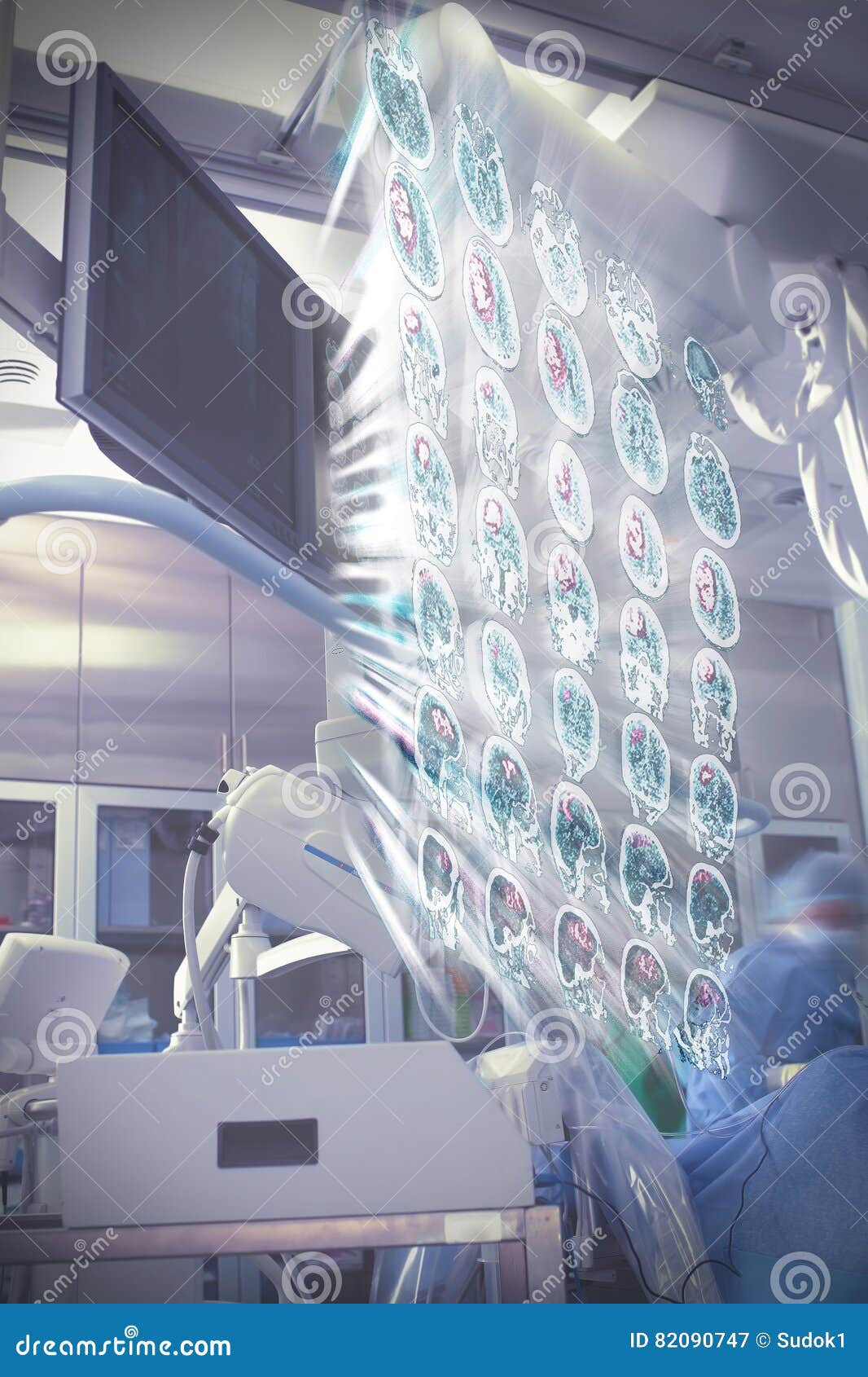 Projection of Head Examination in the Operating Theatre Stock Image ...