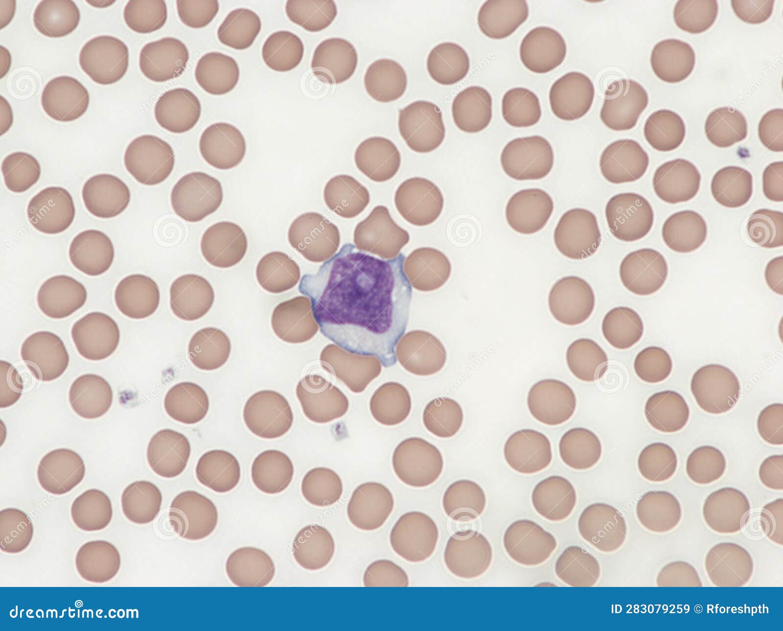 Prolymphocyte stock image. Image of medical, peripheral - 283079259