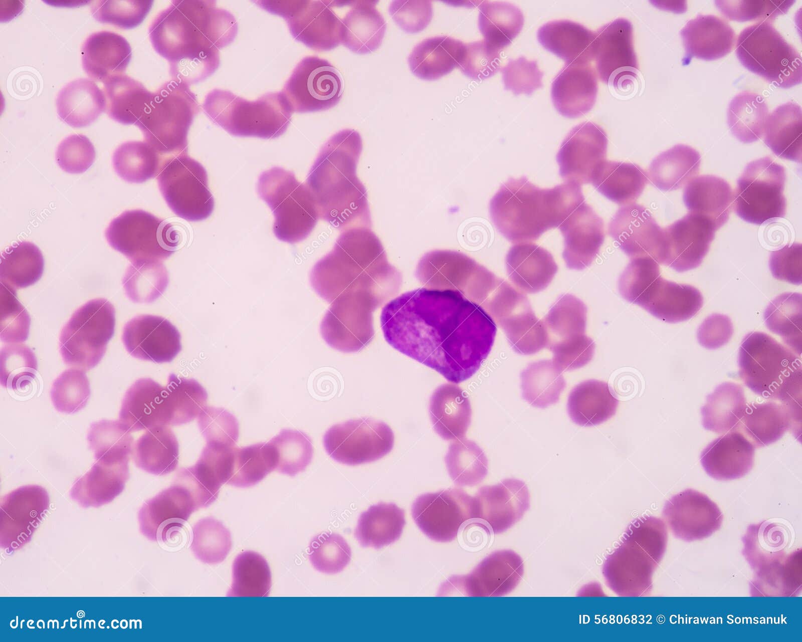 Promyelocyte 库存照片. 图片 包括有 医学, 增量, 微生物学, 针灸师, 的闪烁, 杀菌 - 56806832