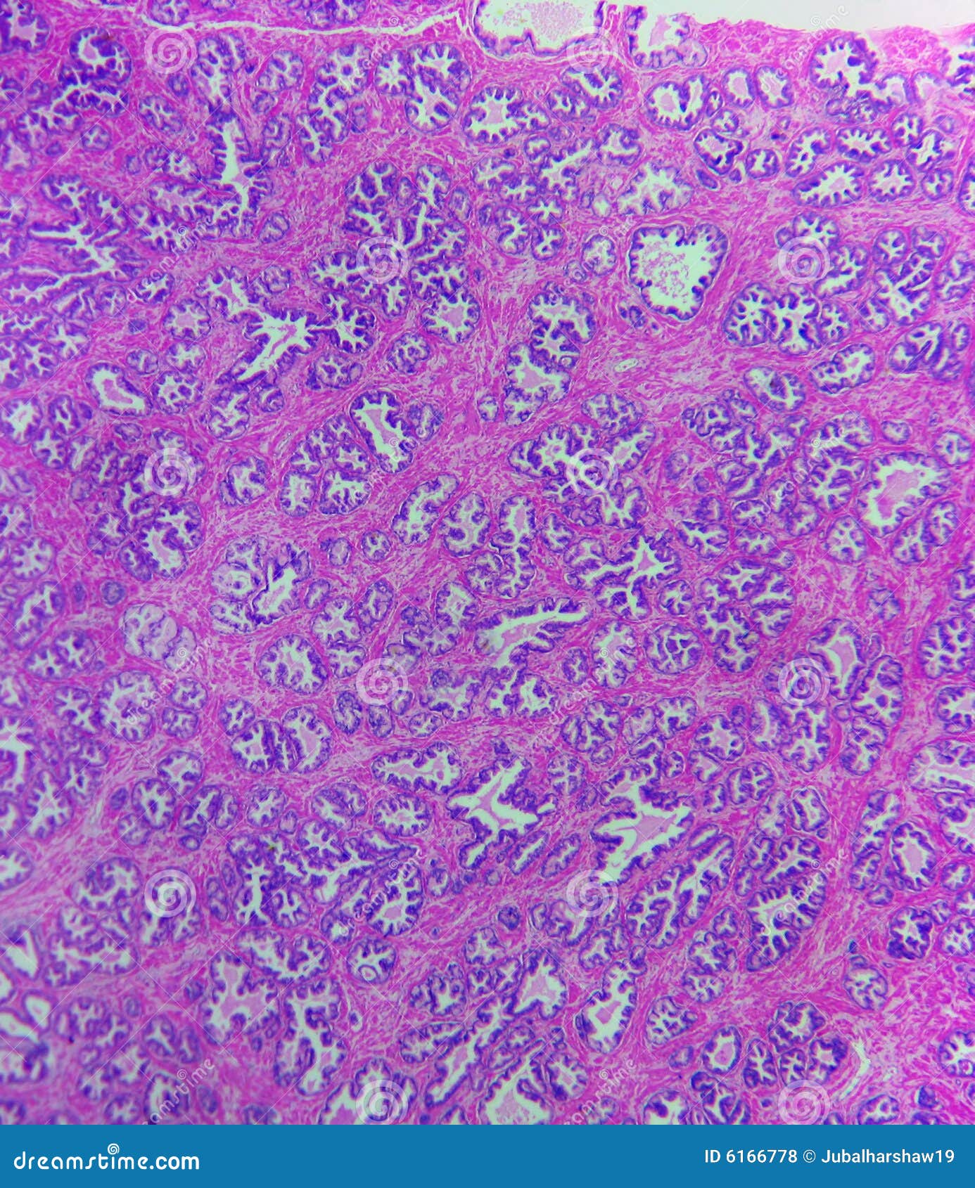 Prostaat Weefsel Jonge Mens Stock Foto - Image of kanker, geneeskunde ...