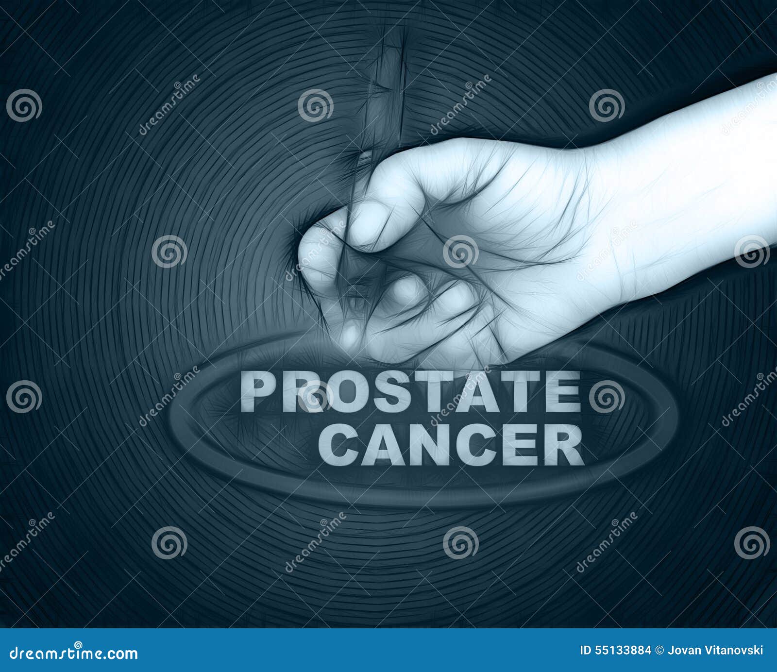 Word Prostate Stock Illustrations – 389 Word Prostate Stock ...