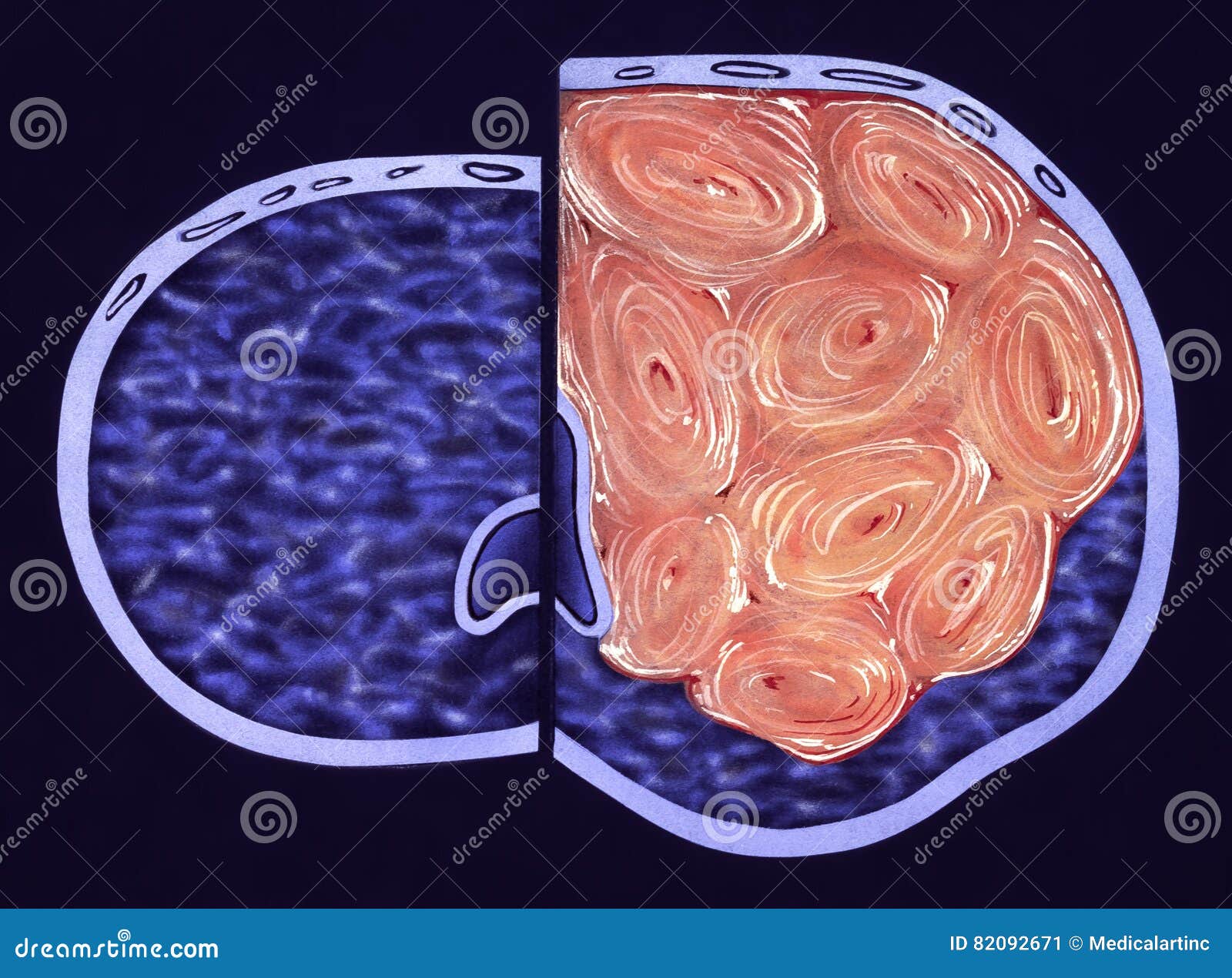 Prostate Gland - Cross Section - False Color Stock Illustration ...