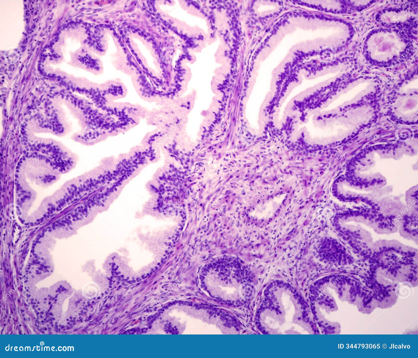 Prostate glands stock image. Image of epithelium, microscope - 344793065
