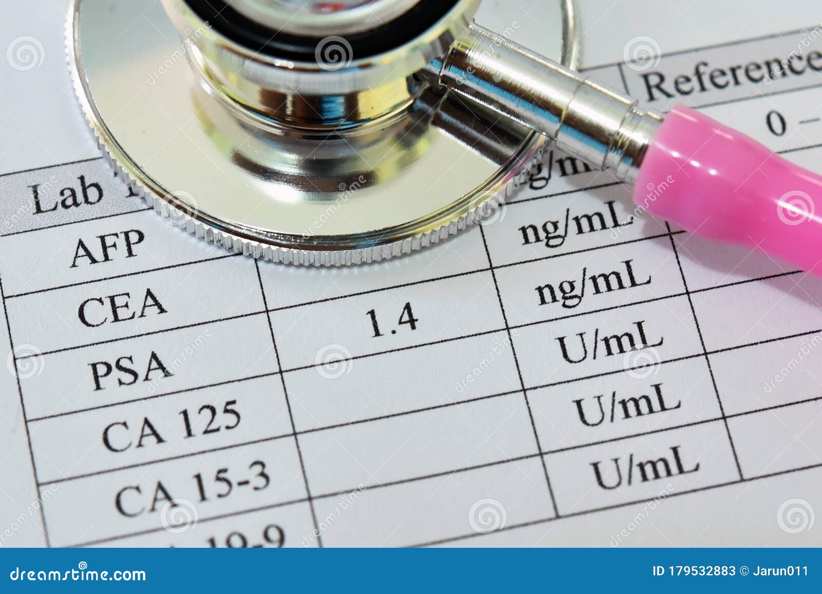 Prostate Specific Antigen or PSA Test Result Stock Image - Image of ...