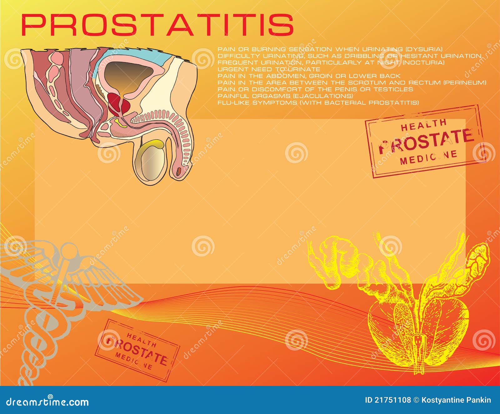 Prostatite illustration de vecteur. Illustration du signe - 21751108