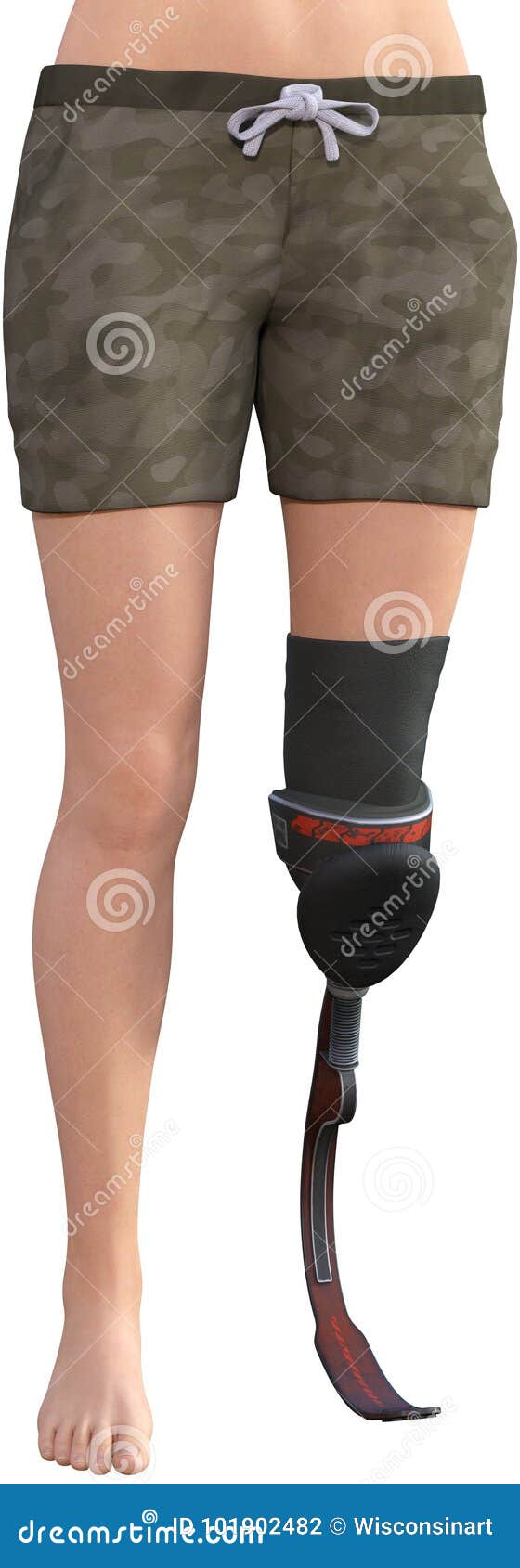 Prosthetic Benamputation, Amputerad Som Isoleras Arkivfoto ...