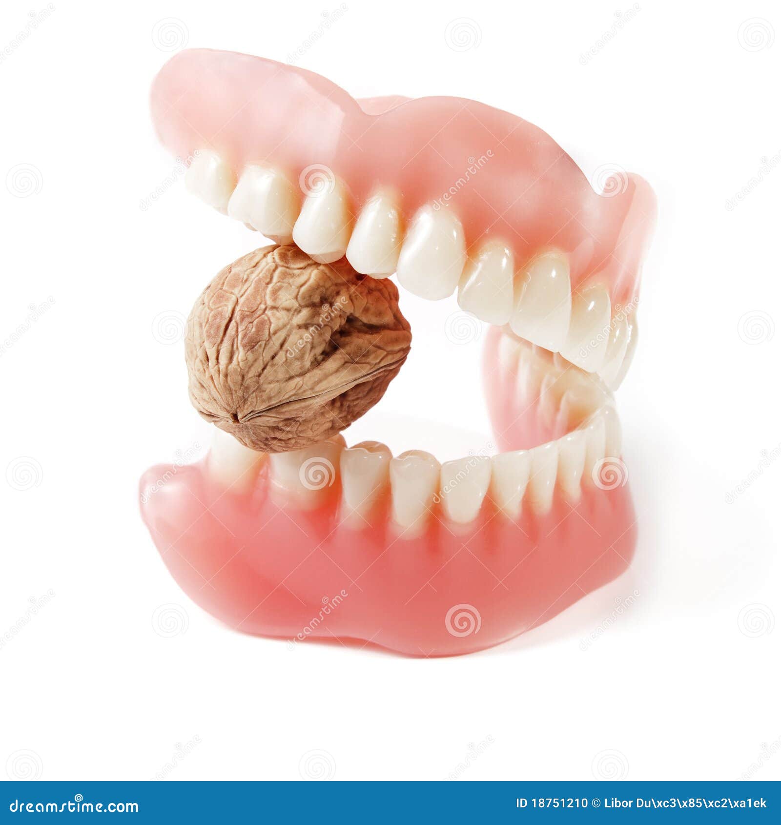 Prosthetic bridge stock photo. Image of gypsum, model - 18751210