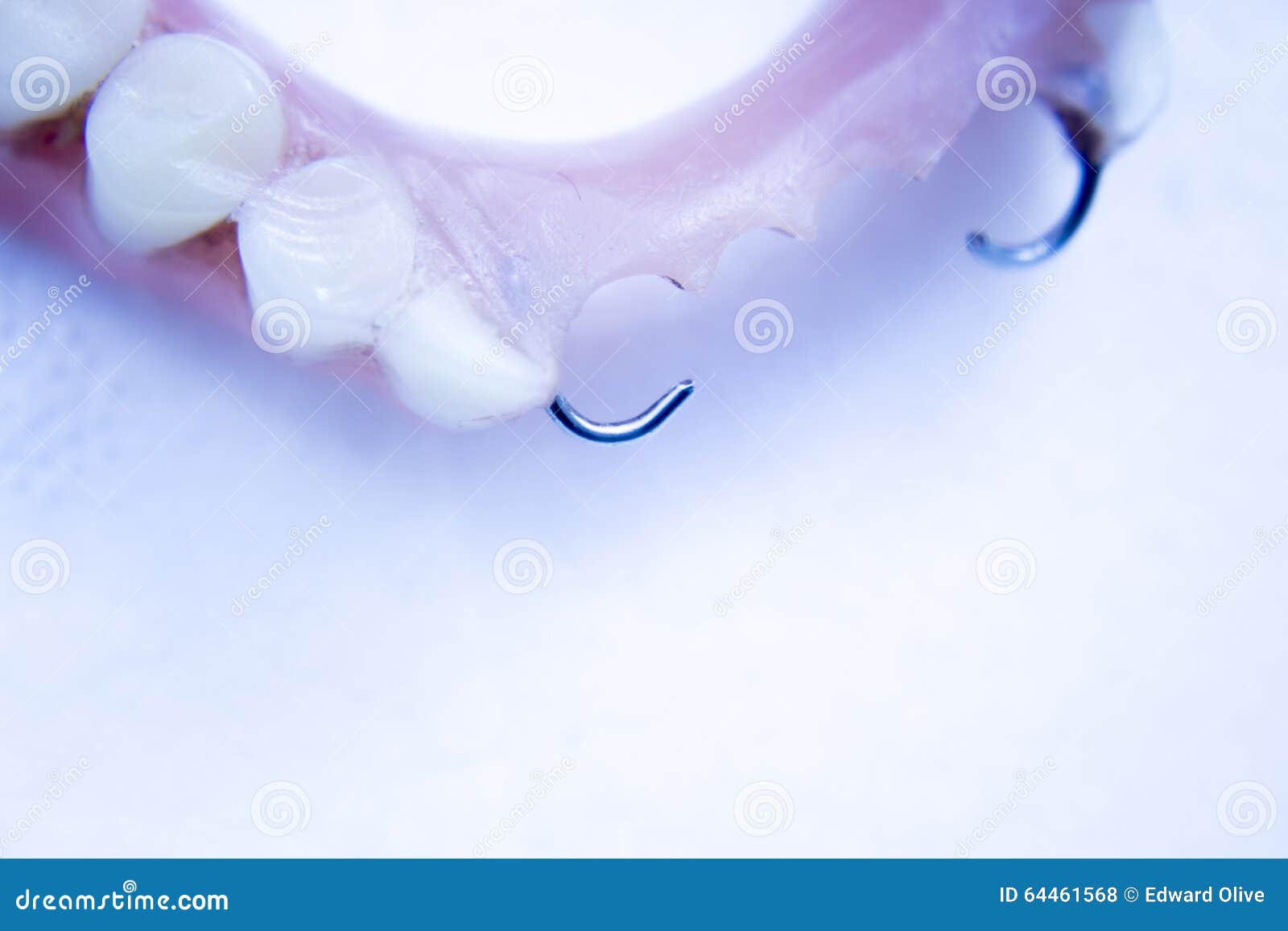 Prosthetic Dental Partial Dentures Stock Photo - Image of dentist, gums ...