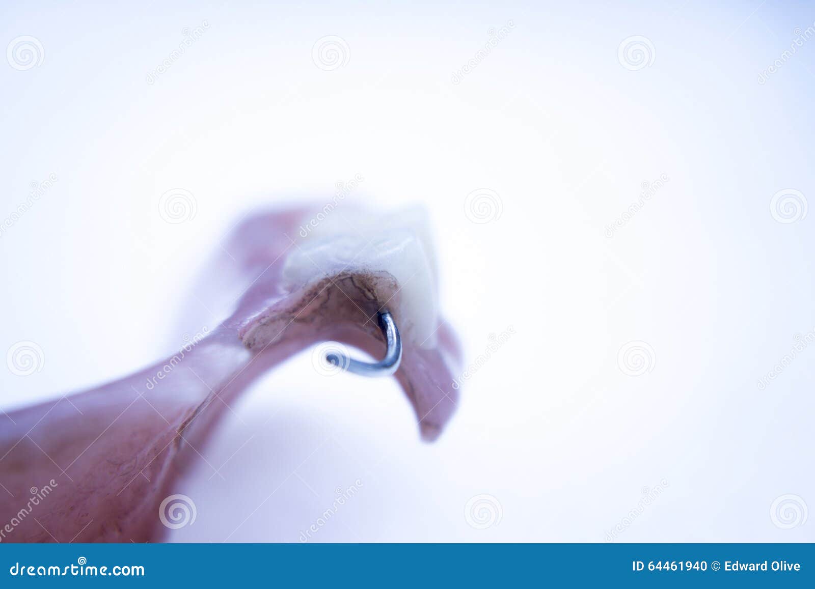 Prosthetic Dental Partial Dentures Stock Photo - Image of artificial ...