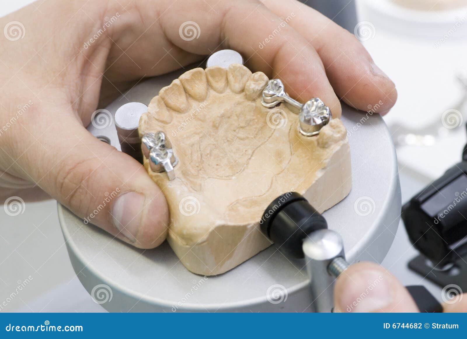 Prosthetic equipment stock photo. Image of crown, position - 6744682