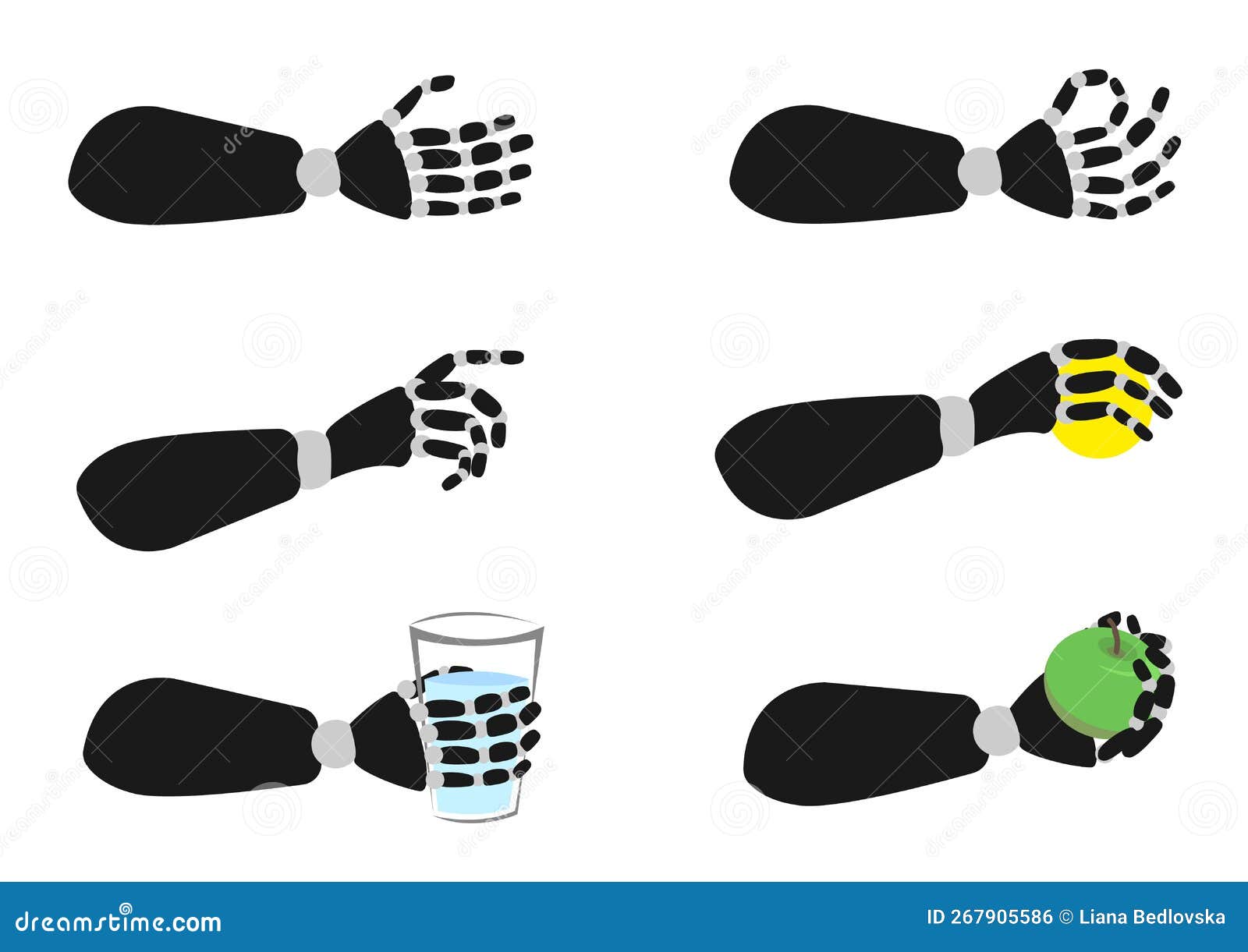 Set of Prosthetic Hands with Different Angles and Gestures Stock Vector ...