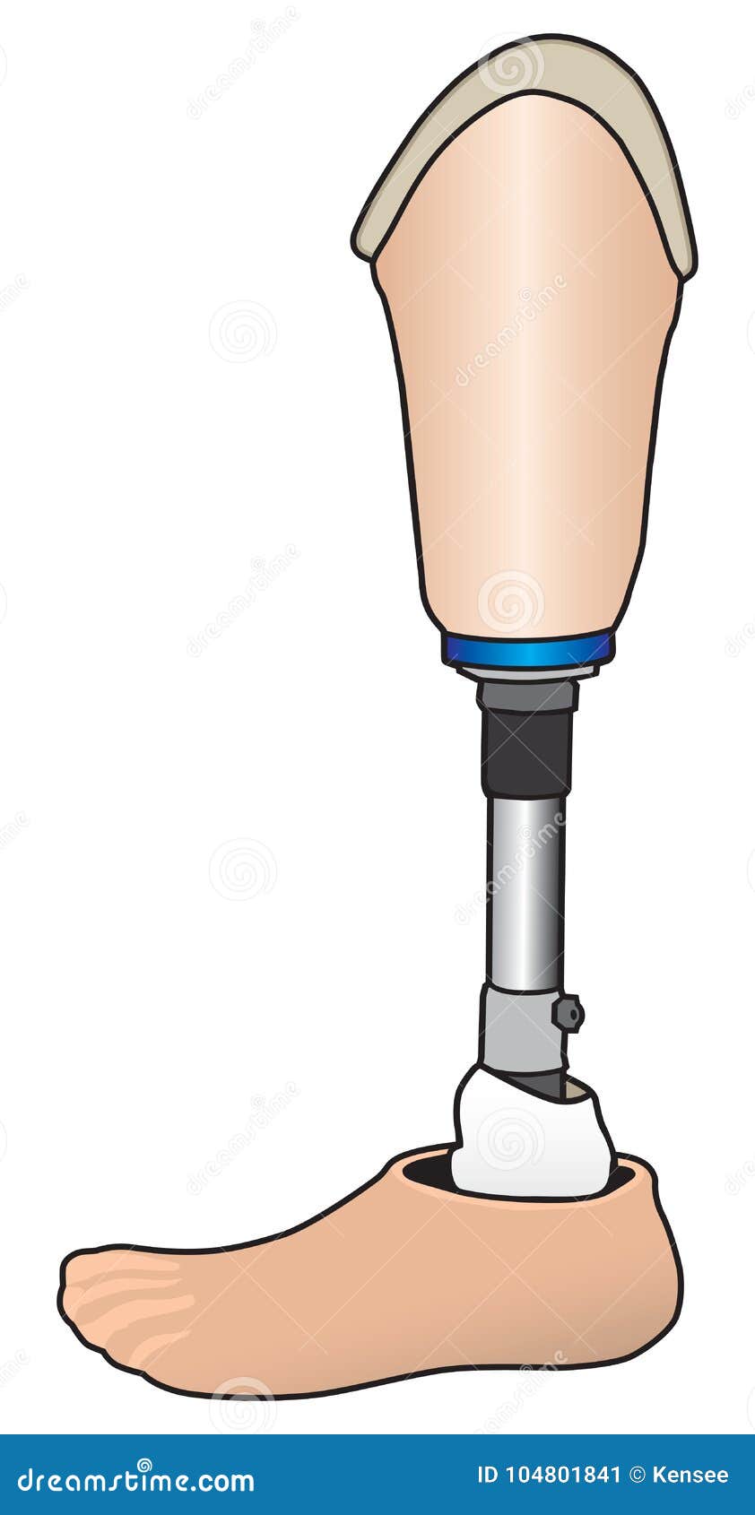 Prosthetic Leg For Amputee Cartoon Vector | CartoonDealer.com #104801841