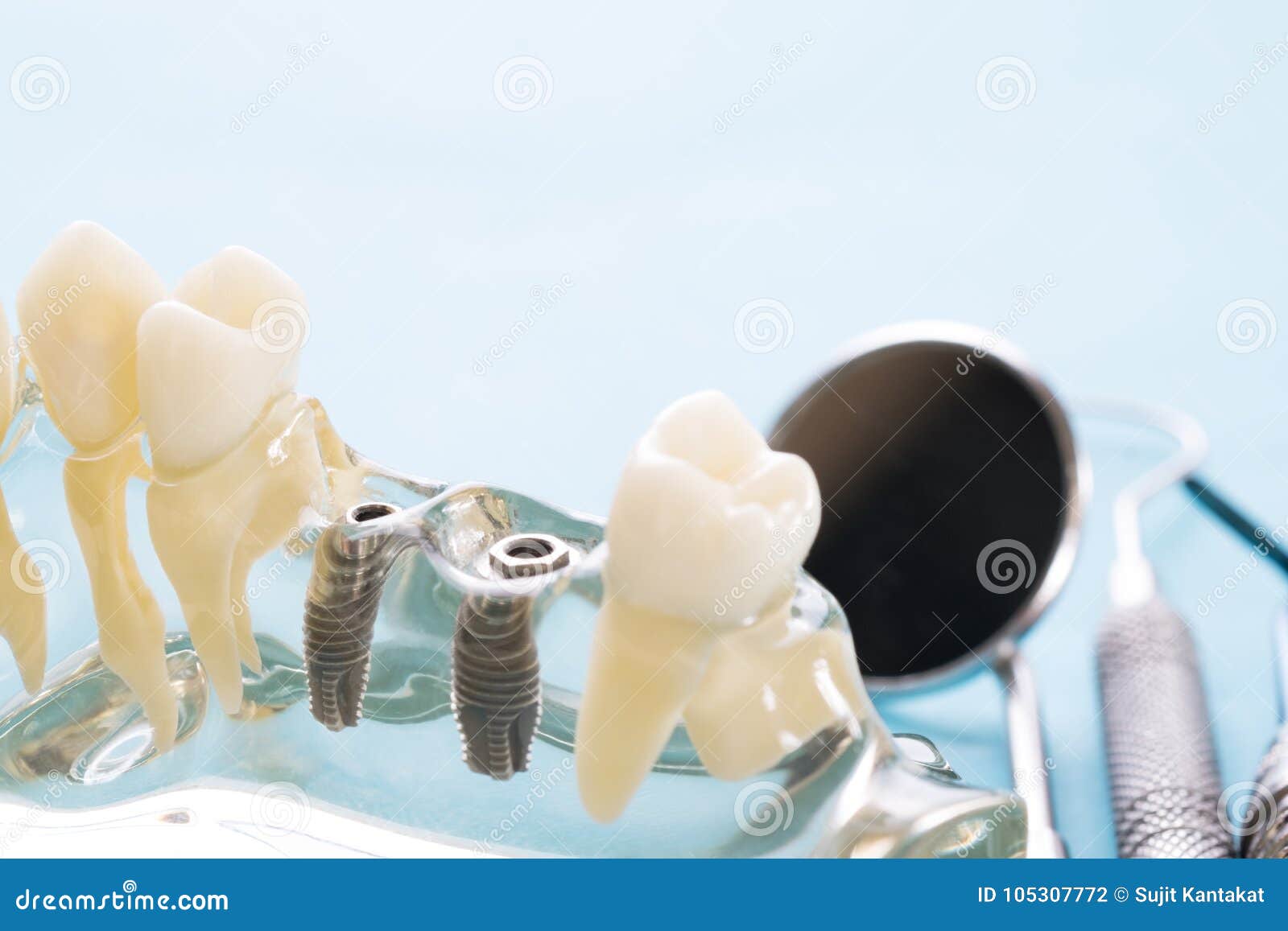 Prosthodontic Model and Tools. Stock Photo - Image of concept ...