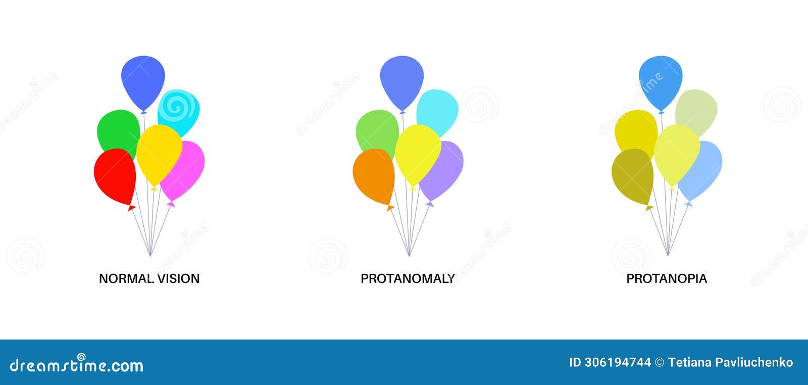 Protanomaly and protanopia stock illustration. Illustration of ...