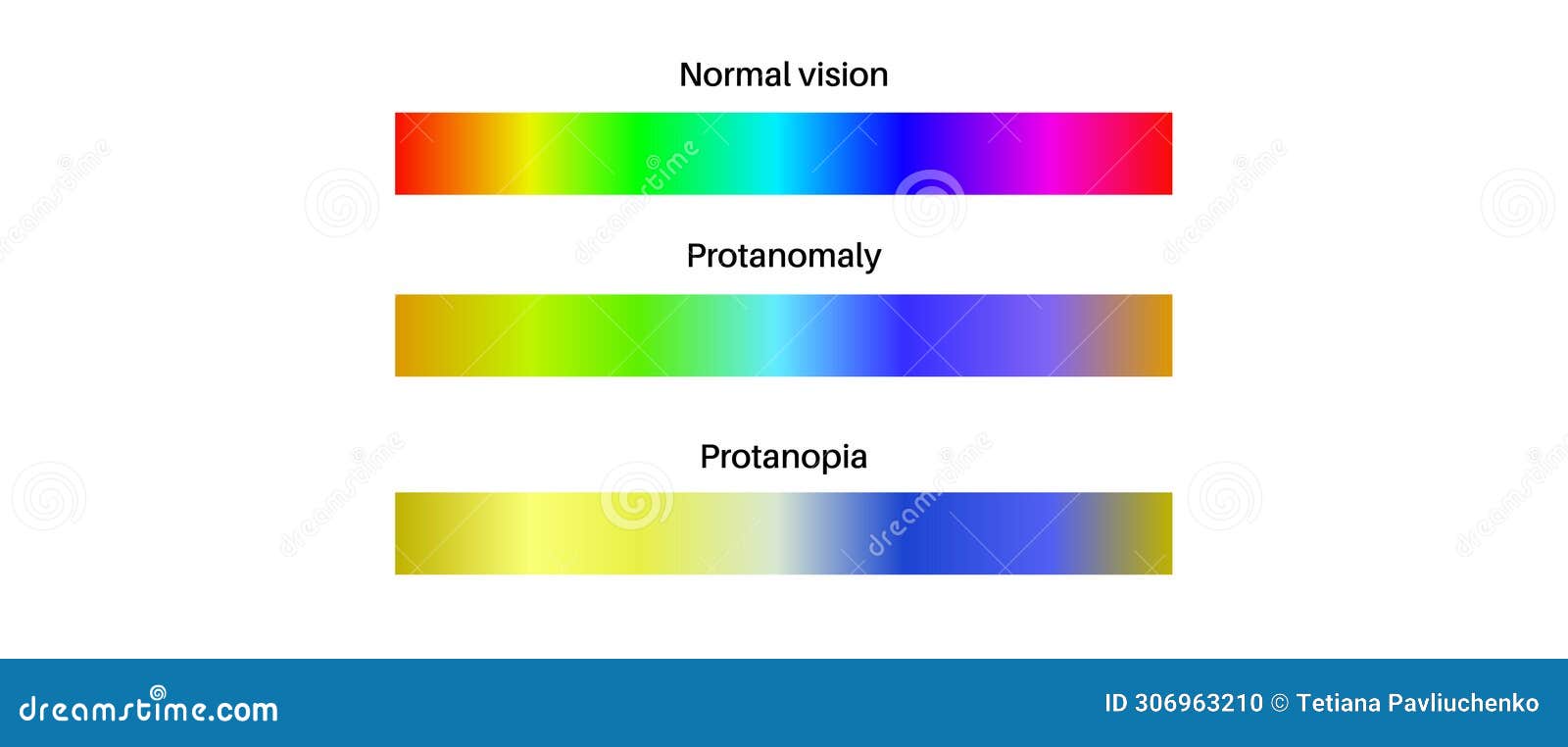 Protanomaly Cartoons, Illustrations & Vector Stock Images - 68 Pictures ...
