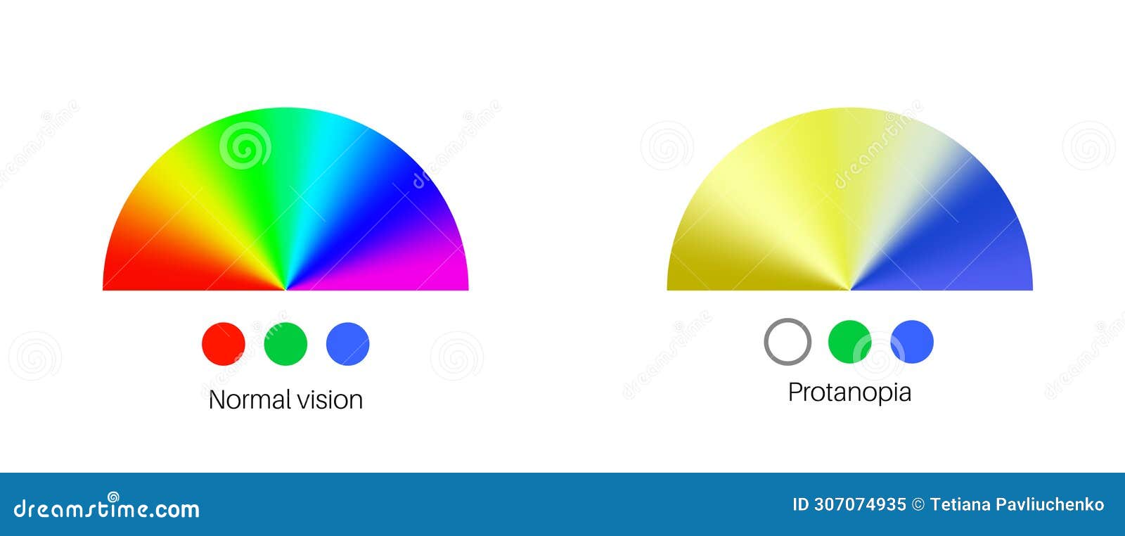 Protanomaly and protanopia stock vector. Illustration of vision - 307074935