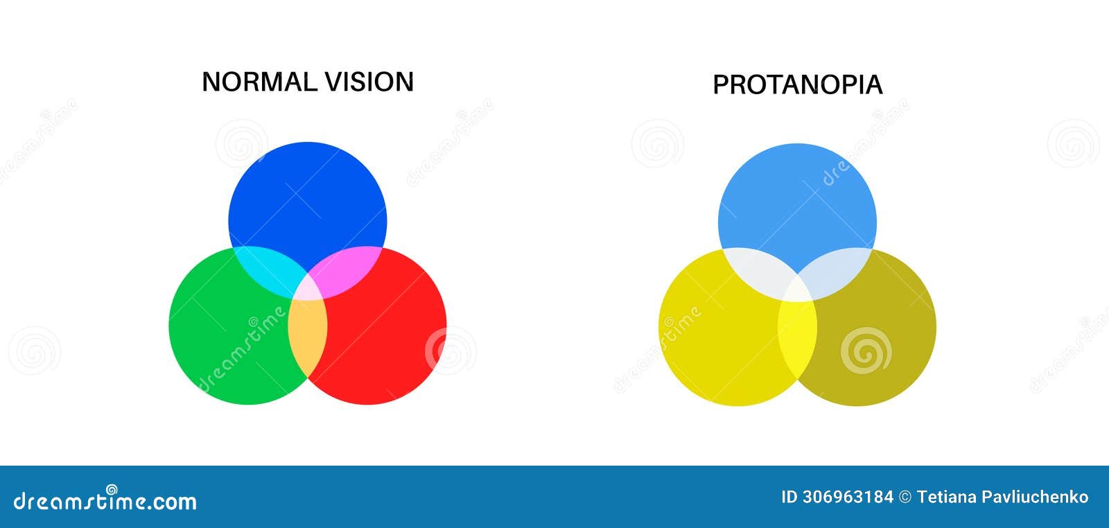 Protanomaly and protanopia stock vector. Illustration of dichromacy ...